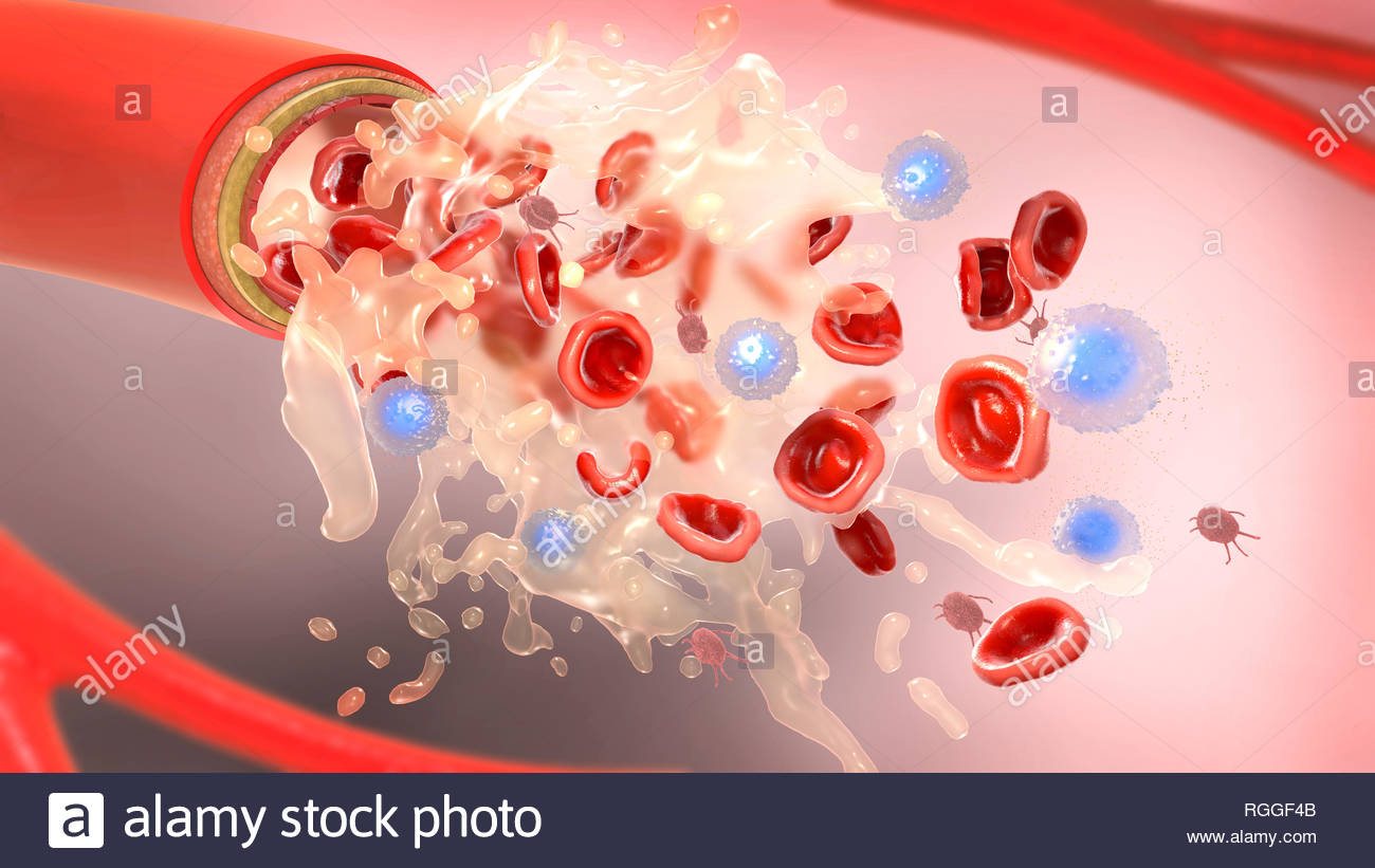Blood Plasma Stock Photos & Blood Plasma Stock Images - Alamy