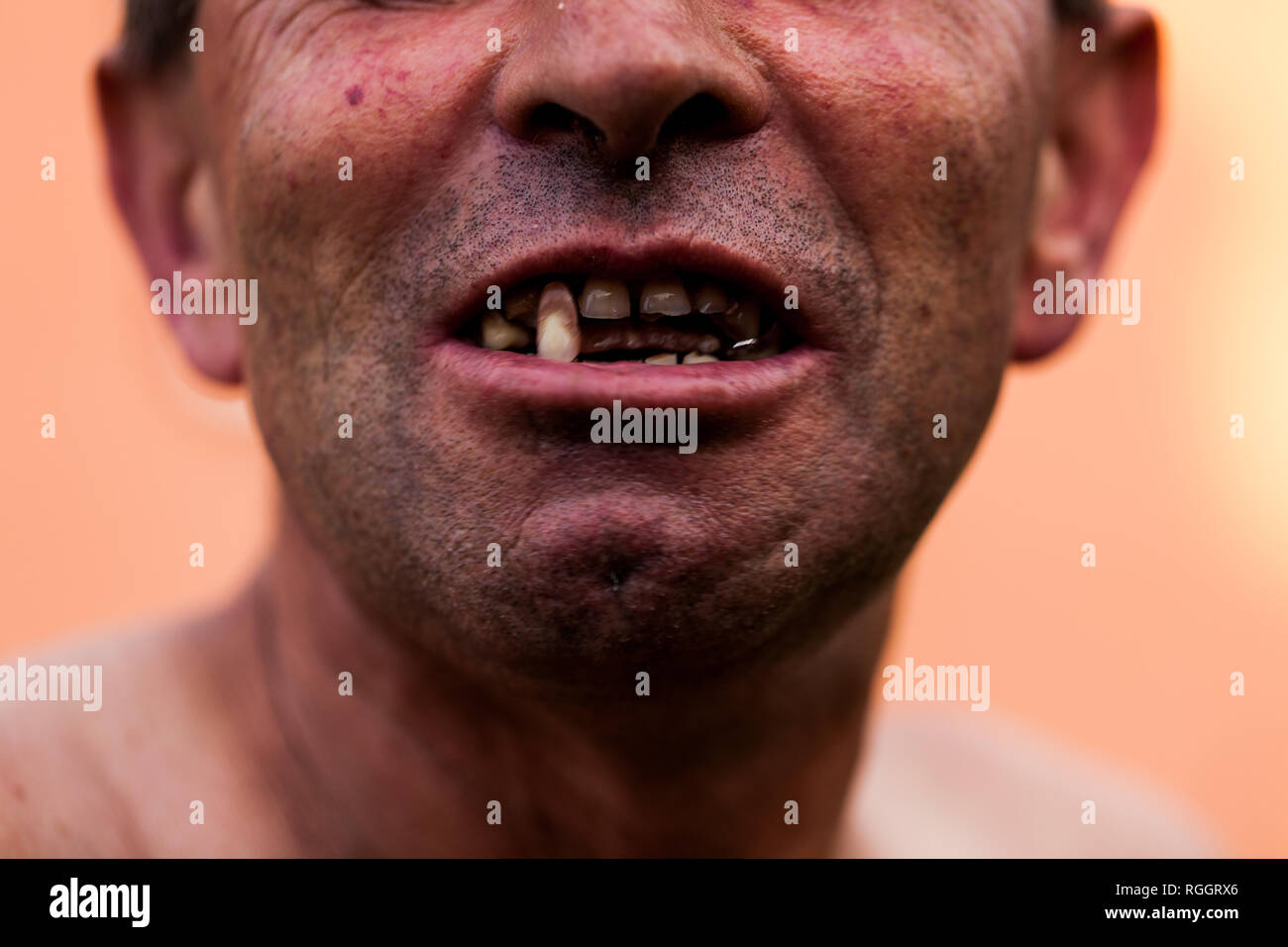 Focused view of an old man showing falling tooth. Plague and decay ...