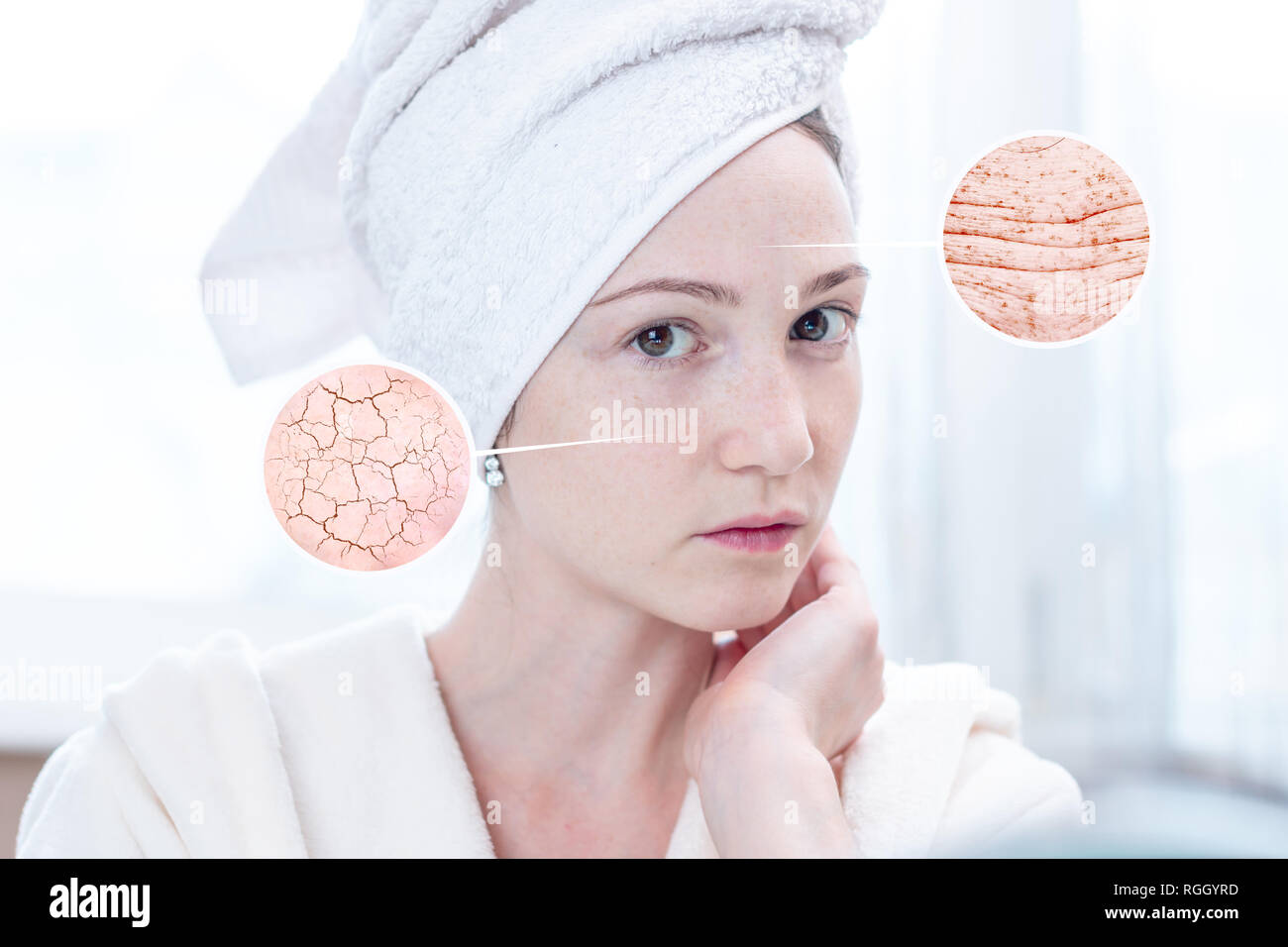 Beautiful young woman with a towel on her head looking at her dry skin ...
