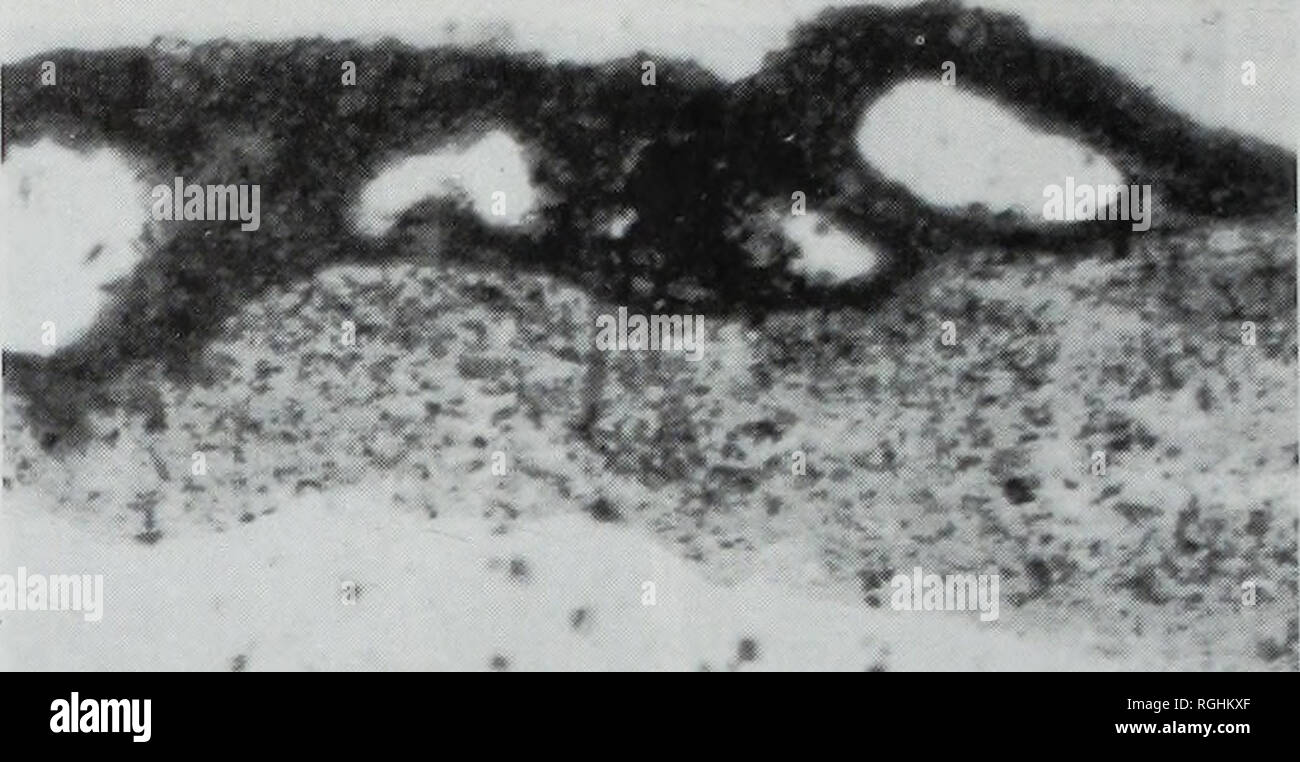 Lower greensand geology hi-res stock photography and images - Alamy