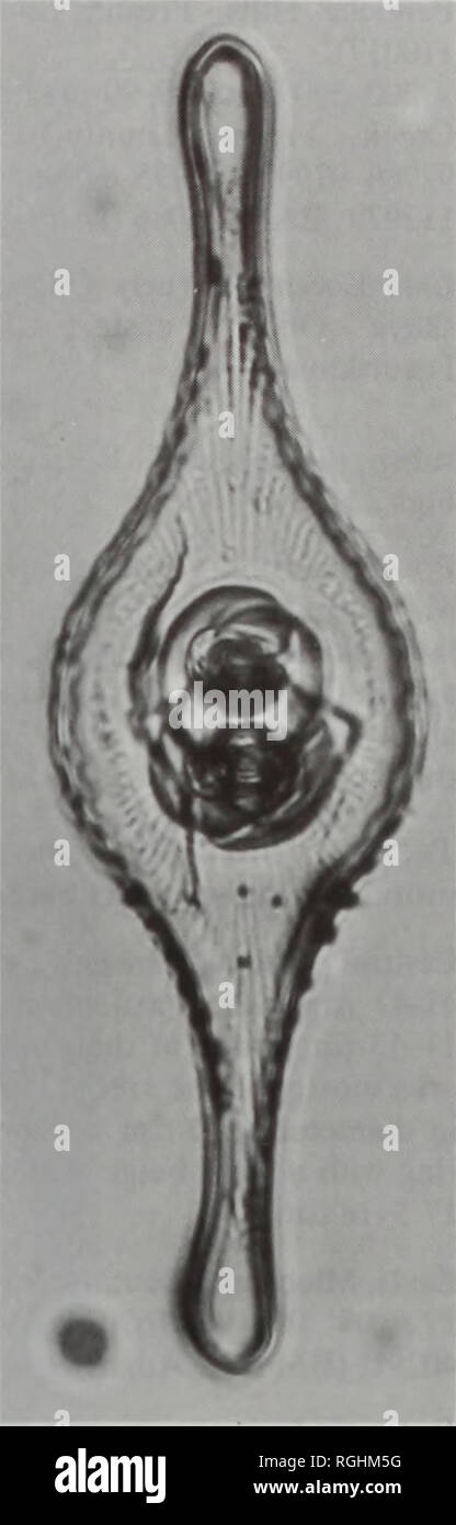 Areolis hi-res stock photography and images - Alamy