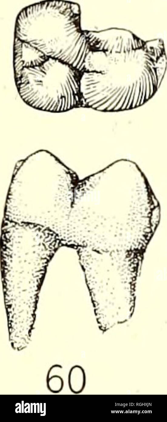 No upper incisor teeth hi-res stock photography and images - Alamy