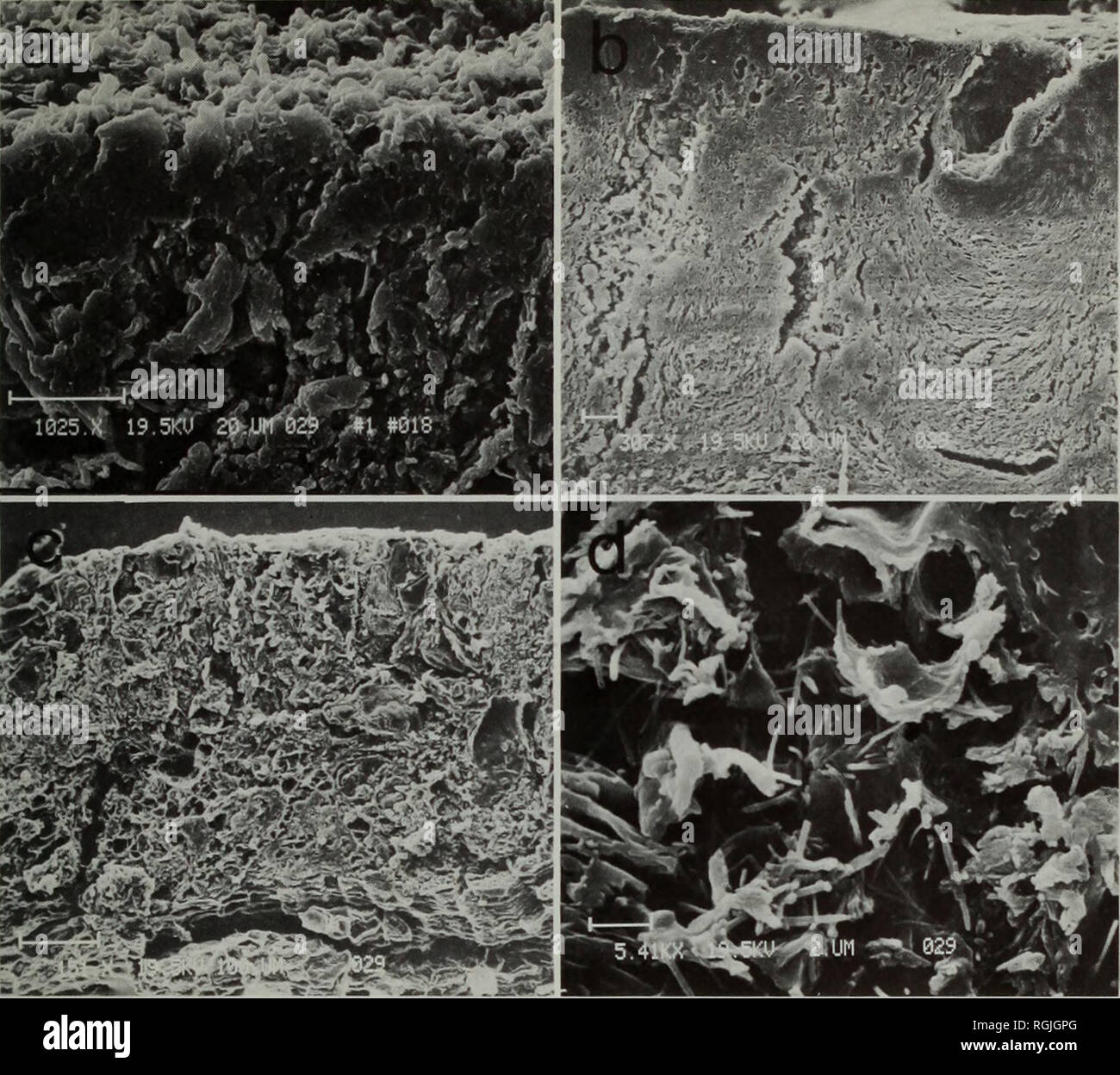 Hyphae microscope hi-res stock photography and images - Alamy