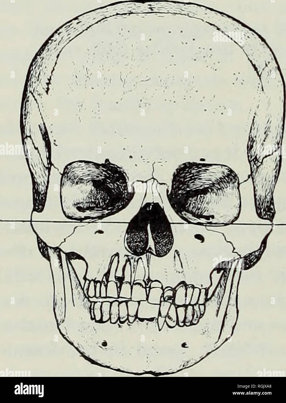 Maxillary prognathism hi-res stock photography and images - Alamy