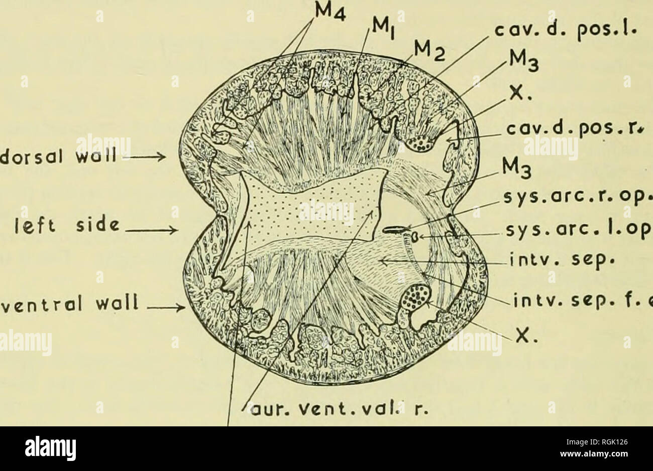 Ventricular septum right ventricle hi-res stock photography and images ...