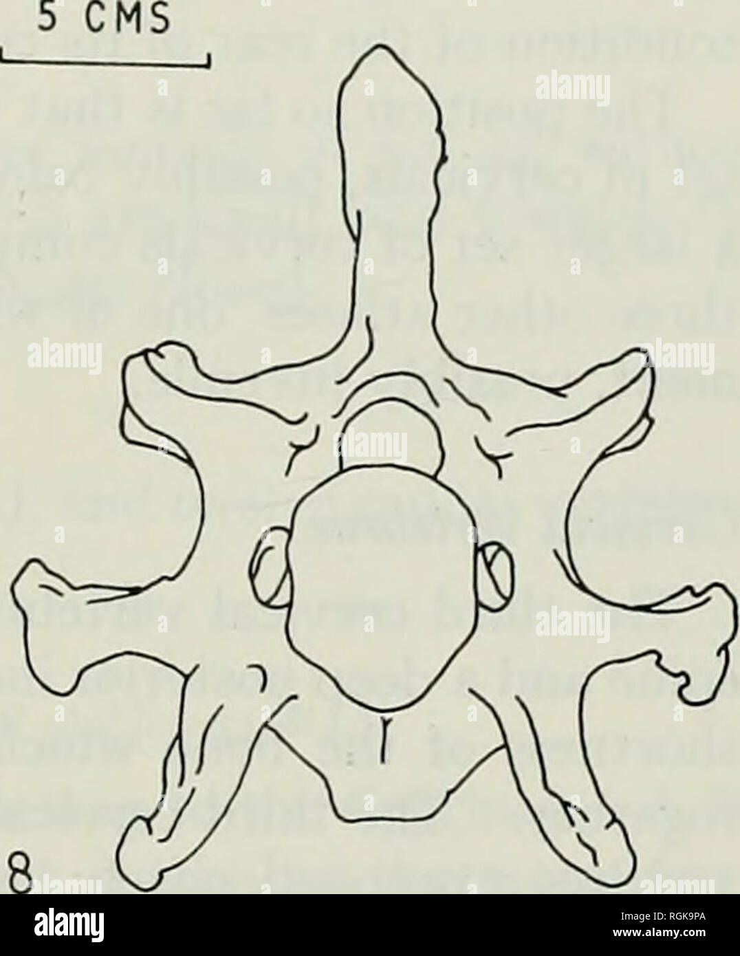 Cervical vertebrae 7 hi-res stock photography and images - Alamy