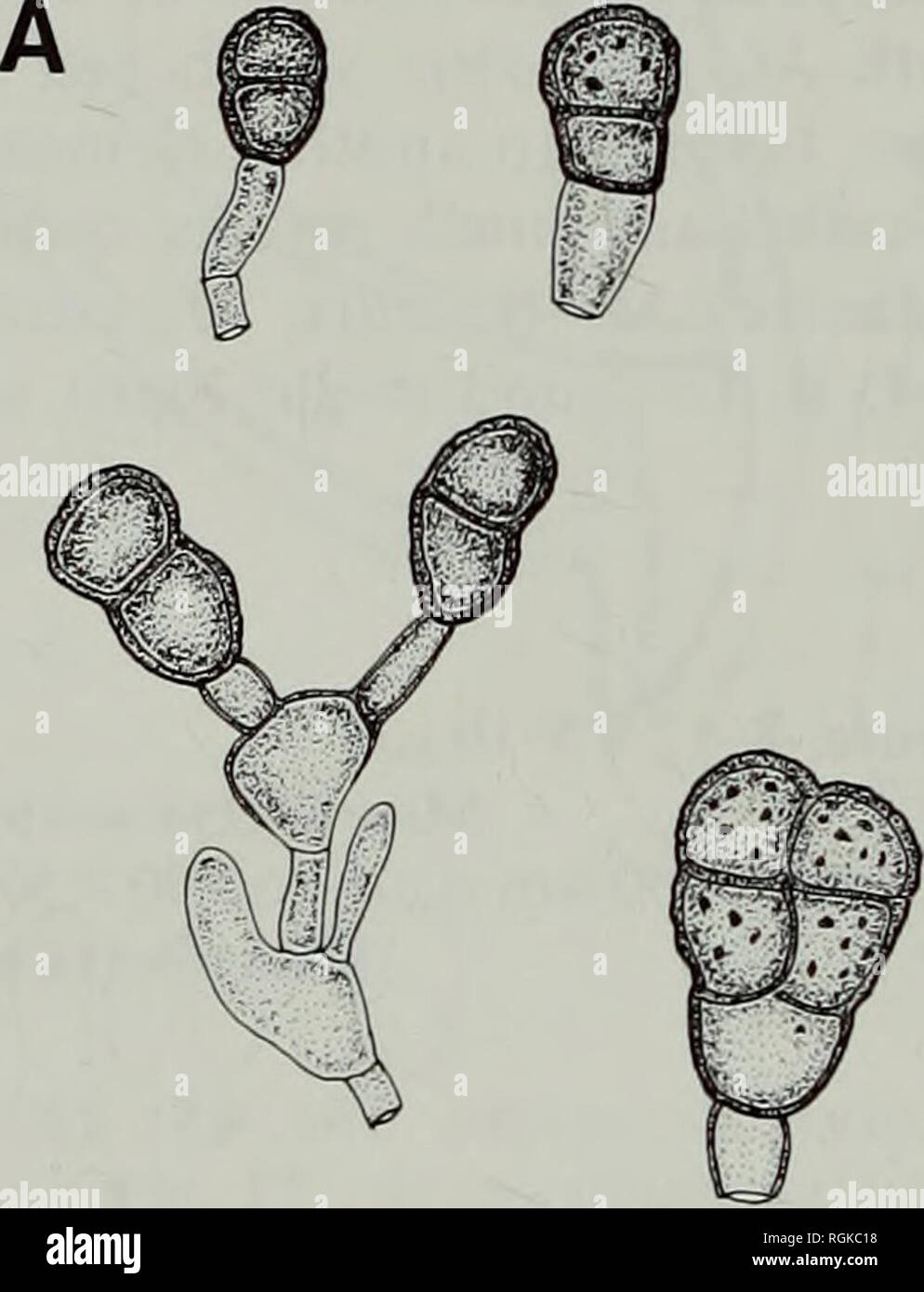 Hyphae septa hi-res stock photography and images - Alamy