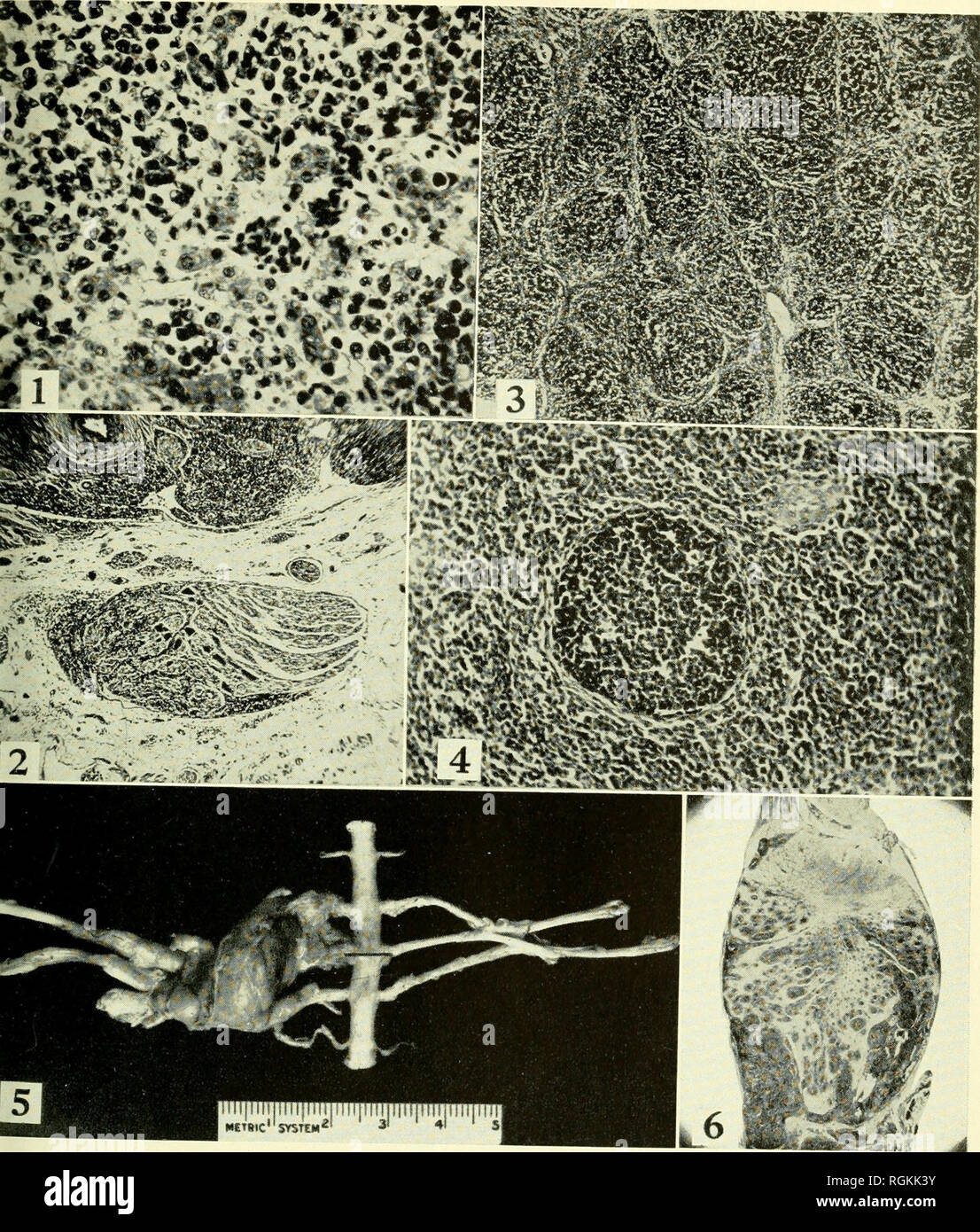 Liver cells diffusion hi-res stock photography and images - Alamy