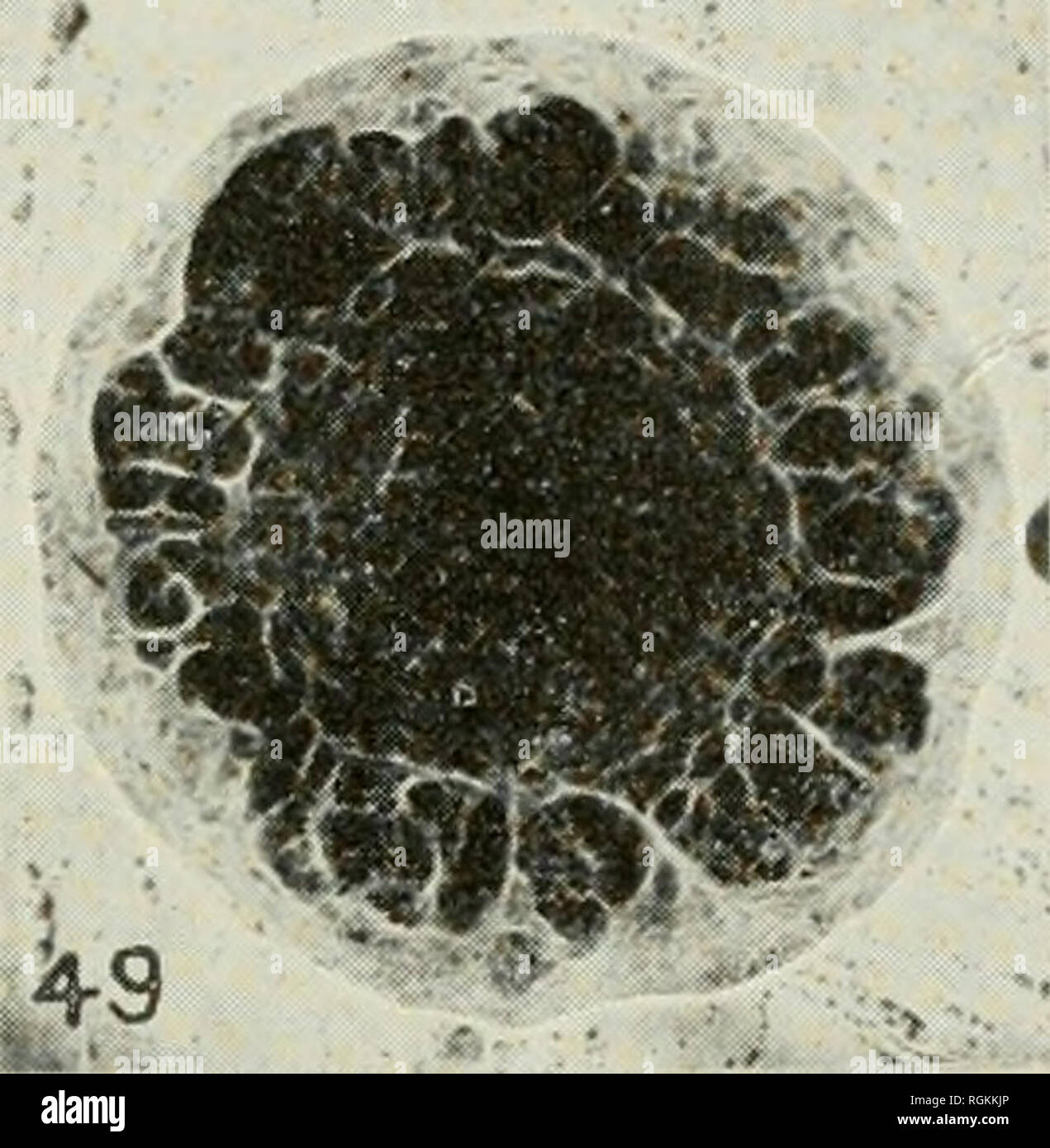 Liver smear hi-res stock photography and images - Alamy