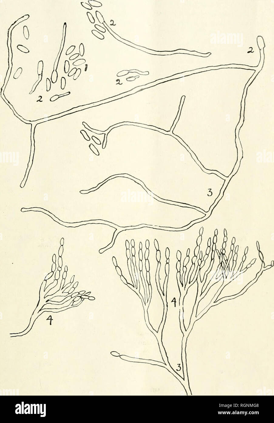 Green muscardine fungus hi-res stock photography and images - Alamy