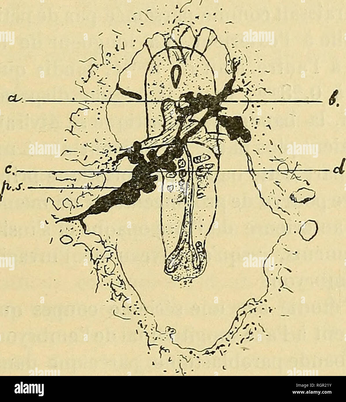 Cyclocephaly hi-res stock photography and images - Alamy
