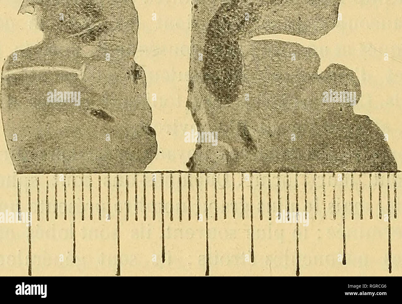 Bissac hi-res stock photography and images - Alamy