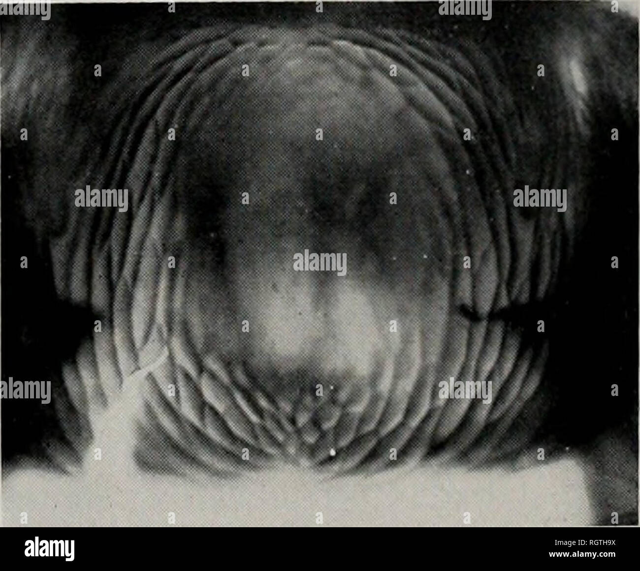 Pelta form hi-res stock photography and images - Alamy