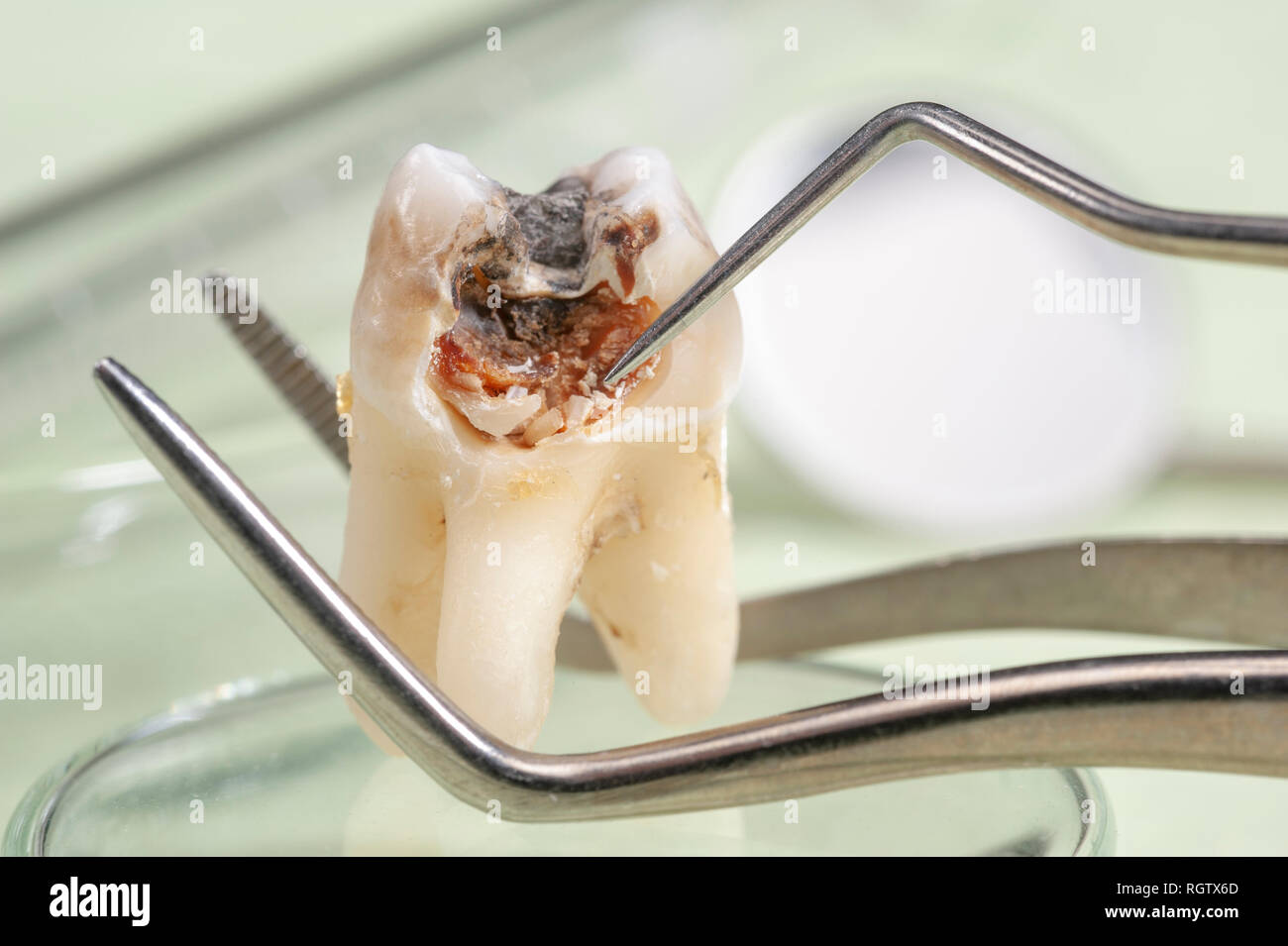 Tooth equipment extraction hi-res stock photography and images - Alamy