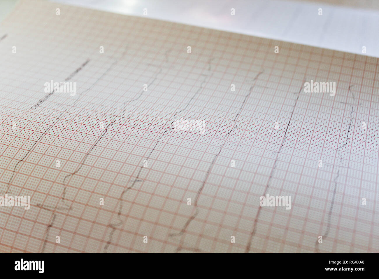 Close up view of an electrocardiogram paper Stock Photo - Alamy