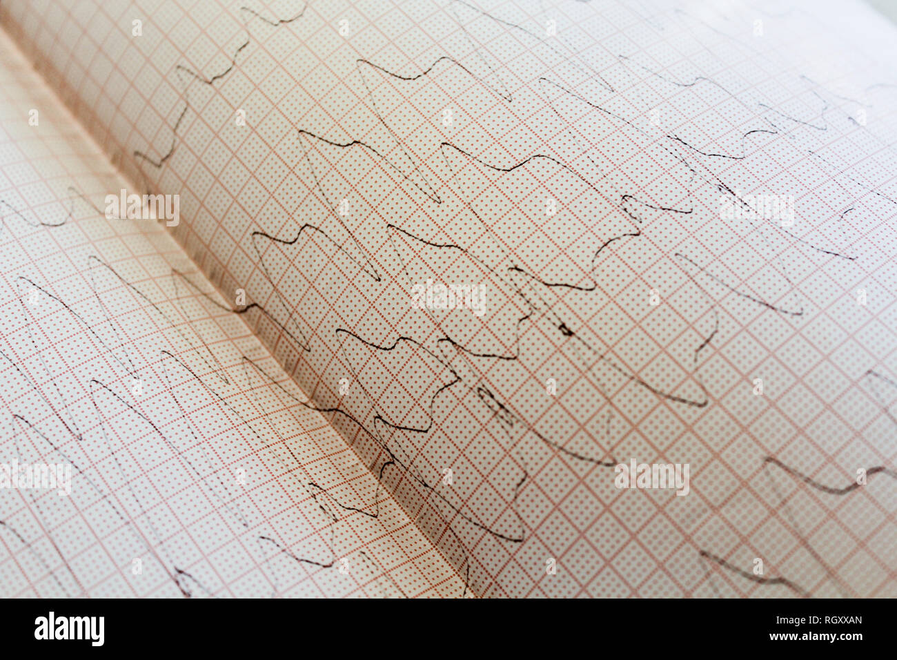 Close up view of an electrocardiogram paper Stock Photo - Alamy