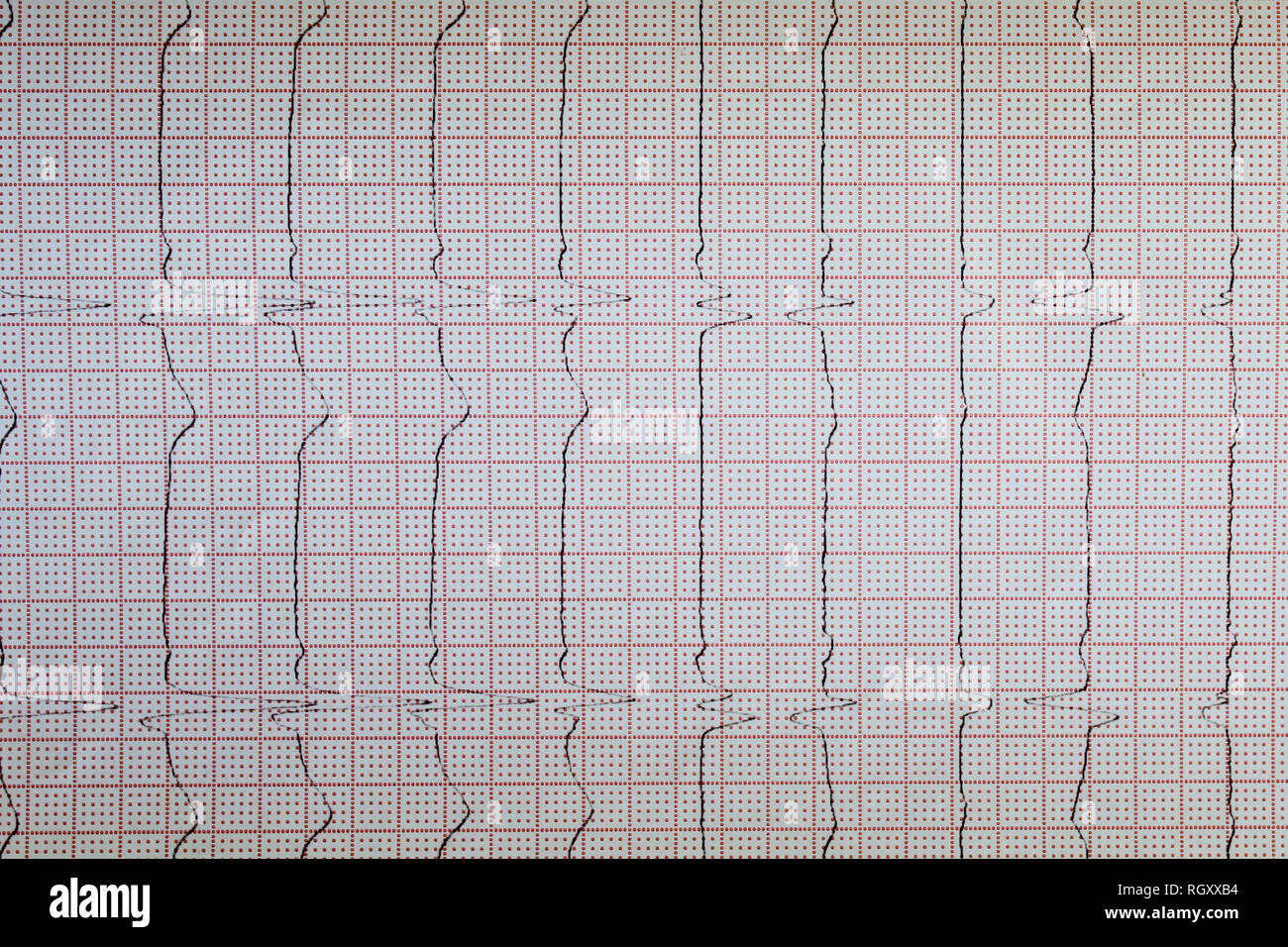 Ekg electrocardiogram closeup view concept hi-res stock photography and ...