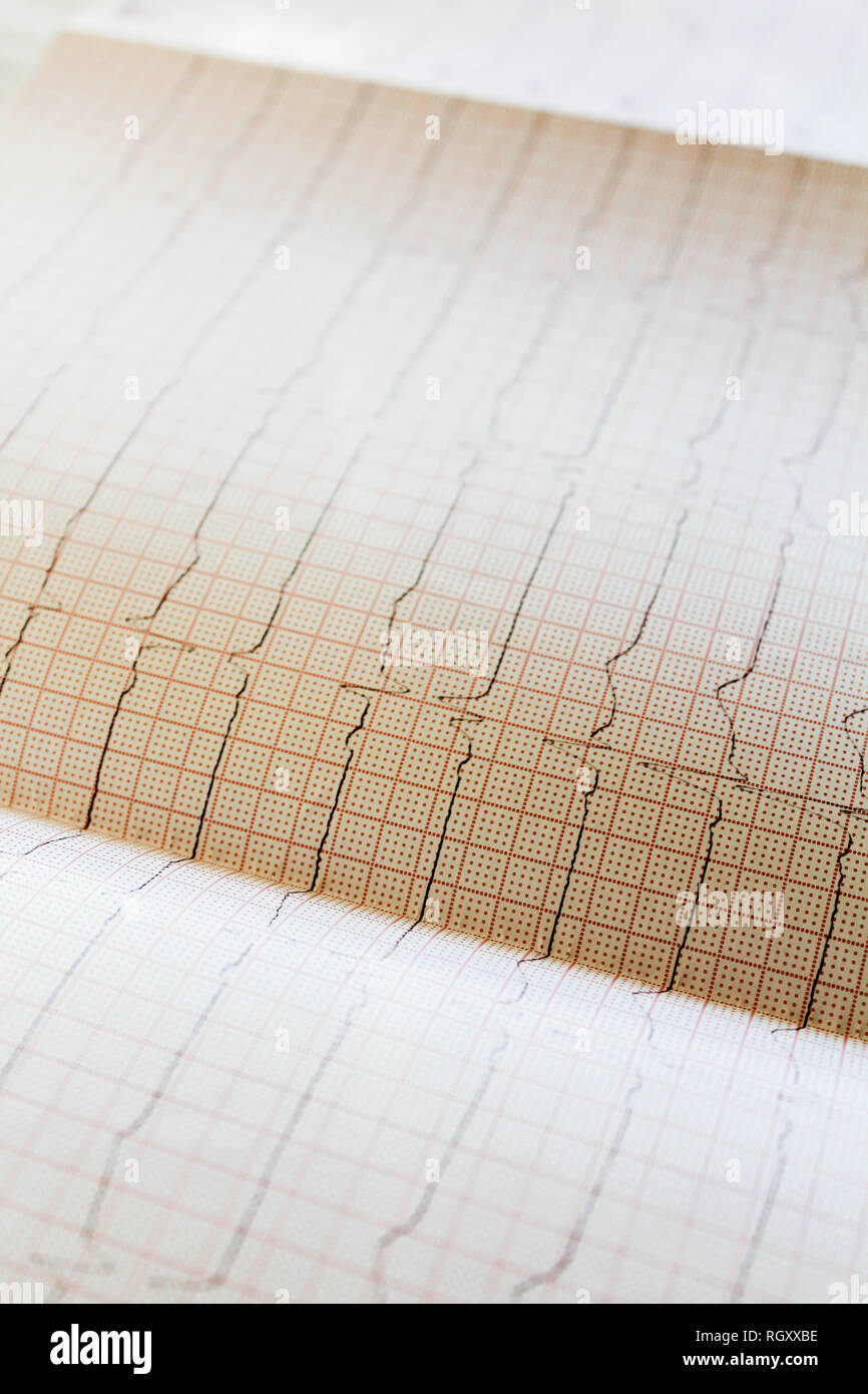 Close up view of an electrocardiogram paper Stock Photo - Alamy