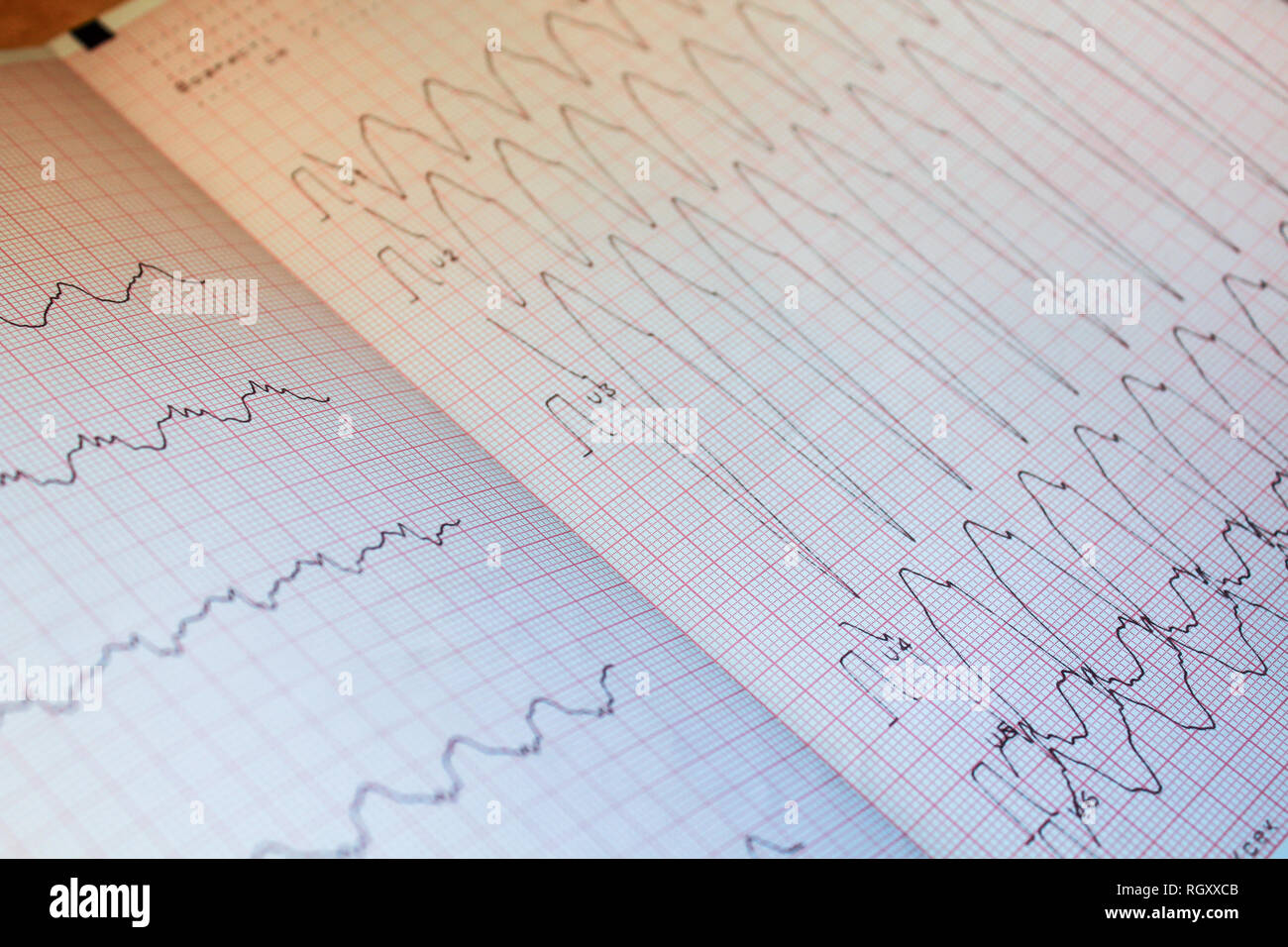 Close up view of an electrocardiogram paper Stock Photo - Alamy
