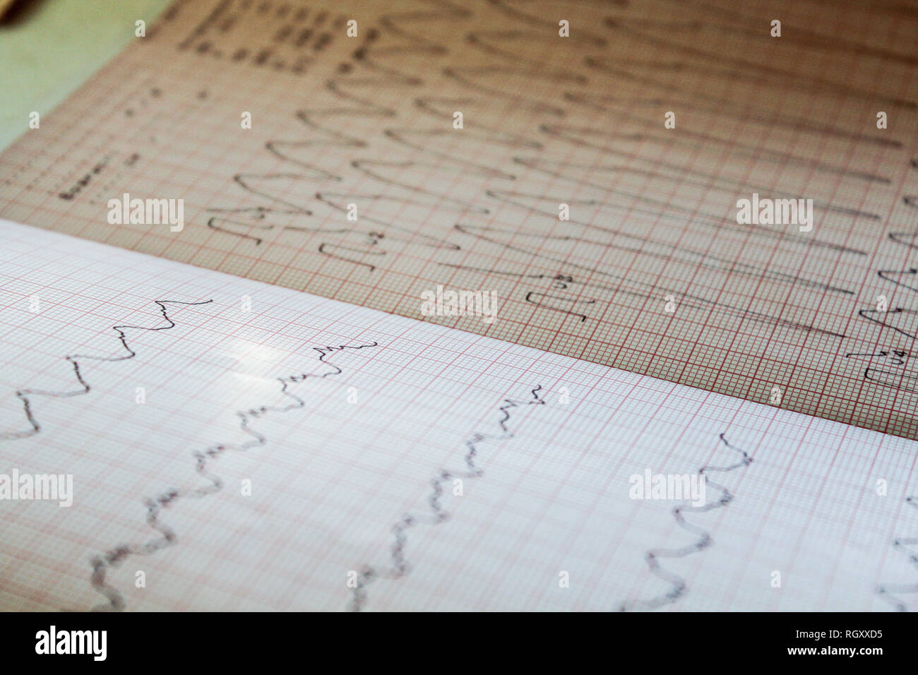 Close up view of an electrocardiogram paper Stock Photo - Alamy