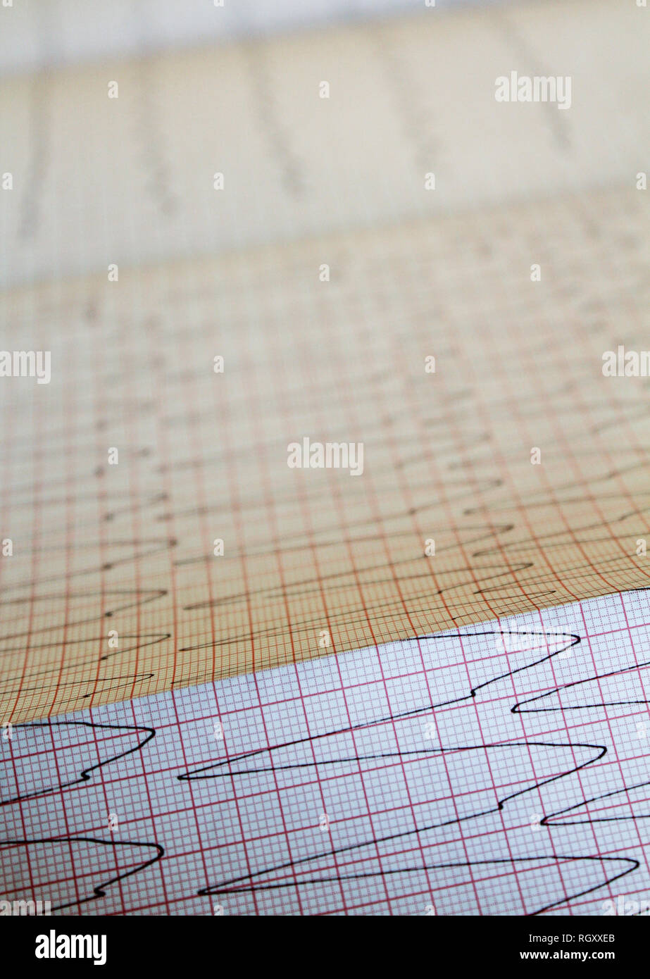 Close up view of an electrocardiogram paper Stock Photo - Alamy