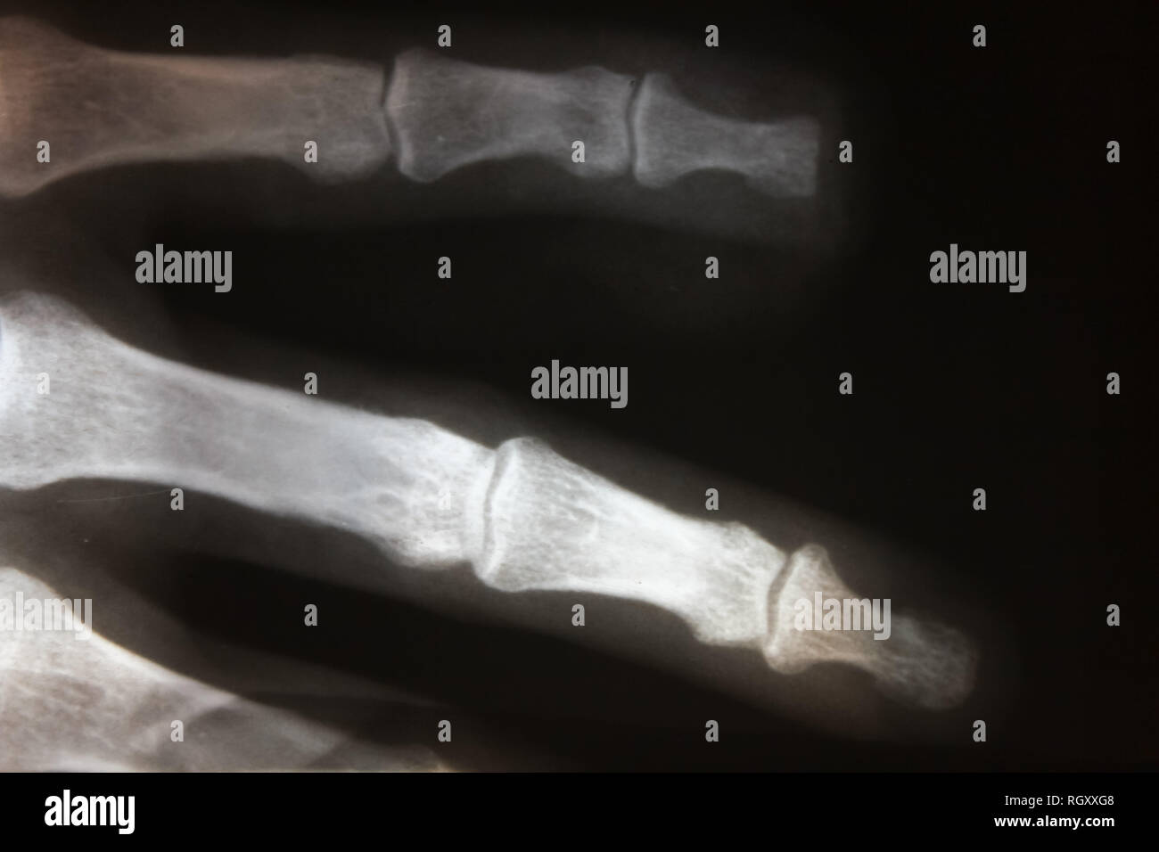 x-ray image of human body parts, x-ray picture, roentgen Stock Photo ...