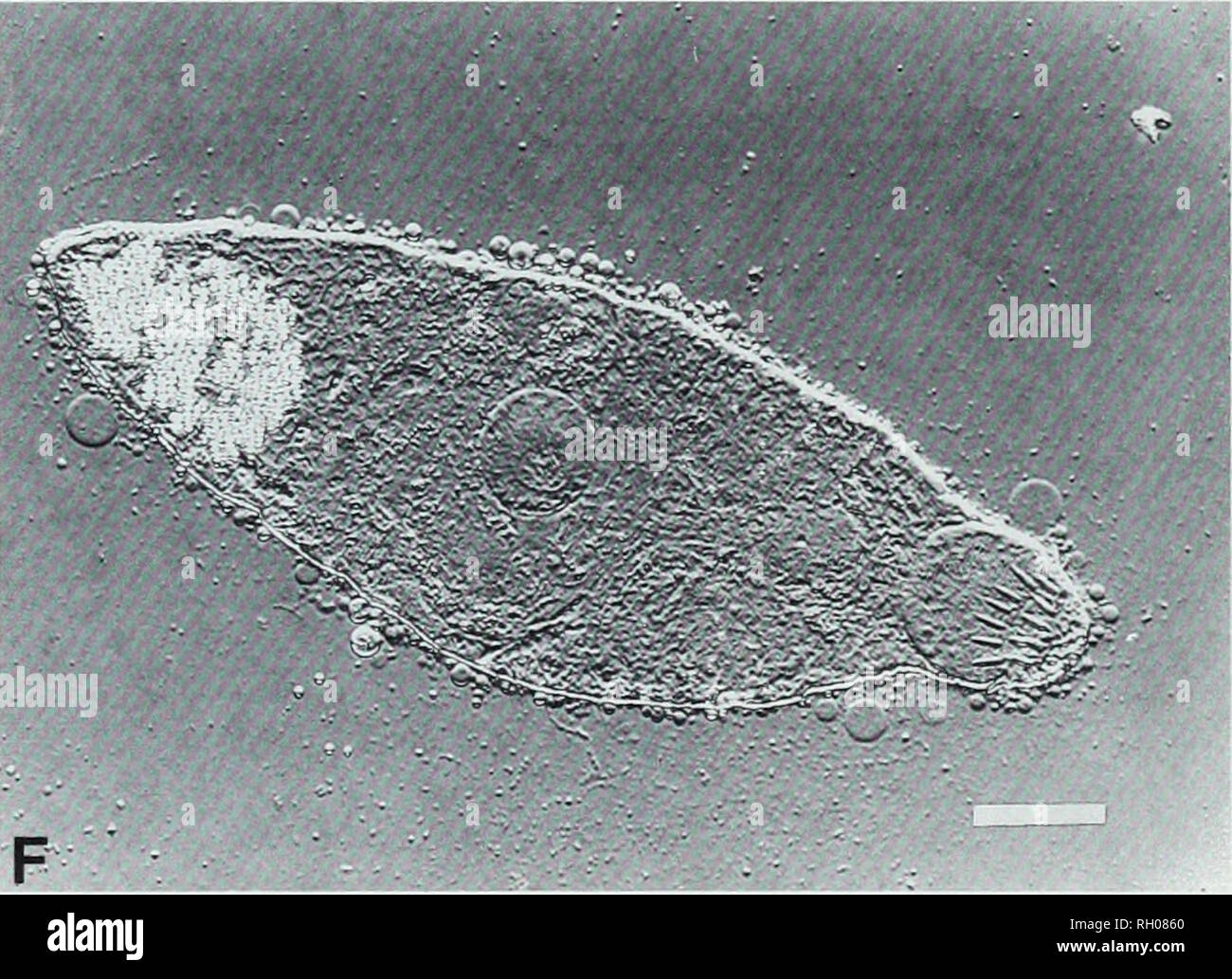 Metacercaria hi-res stock photography and images - Alamy