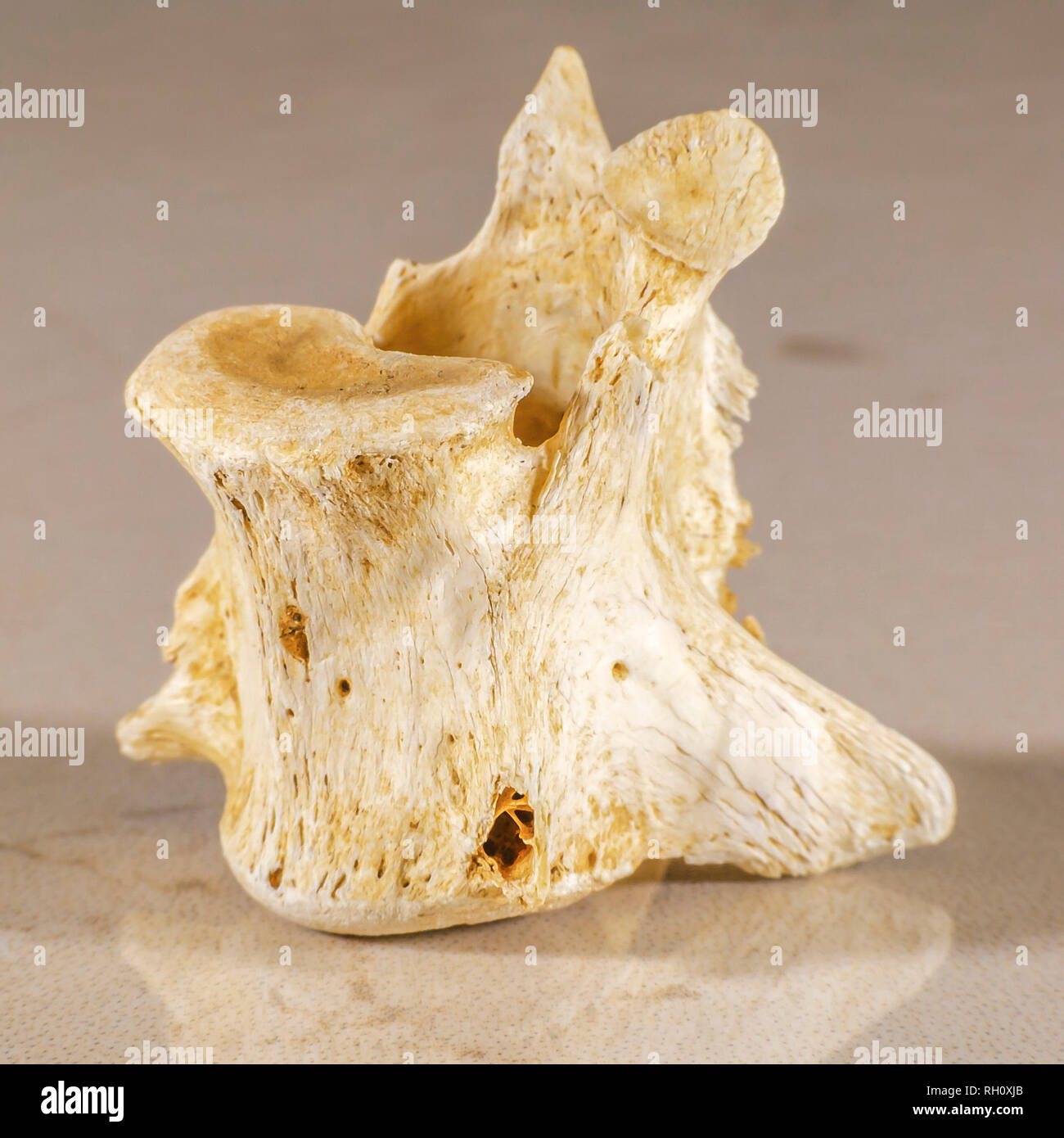 Human backbone hi-res stock photography and images - Alamy