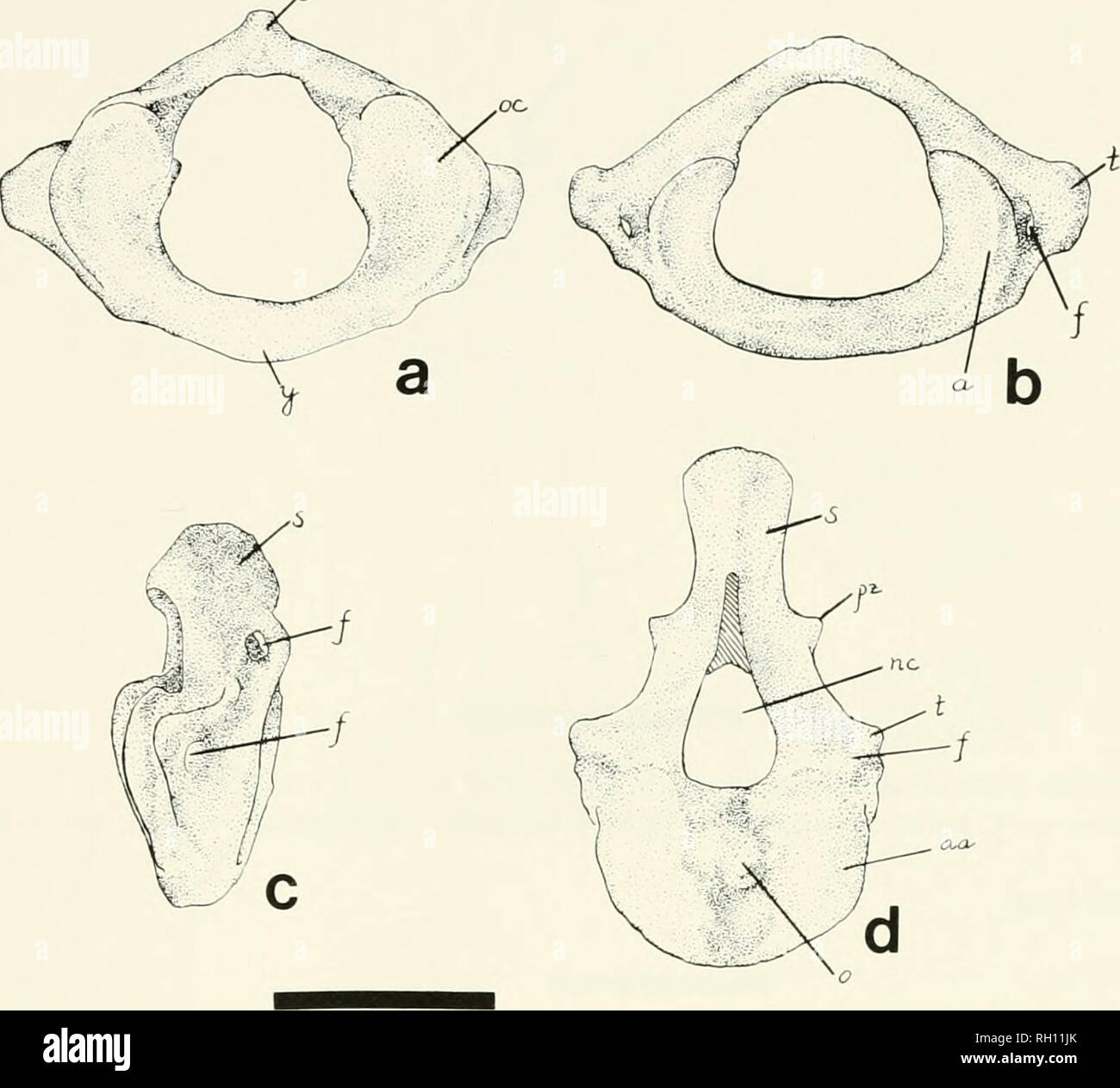 Anterior tubercle of the atlas hi-res stock photography and images - Alamy