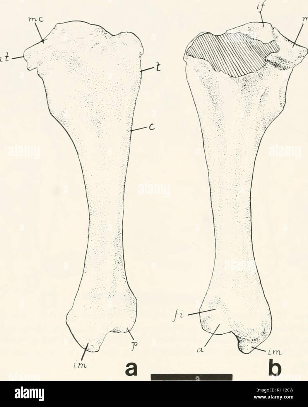 Intercondylar Fossa Tibia