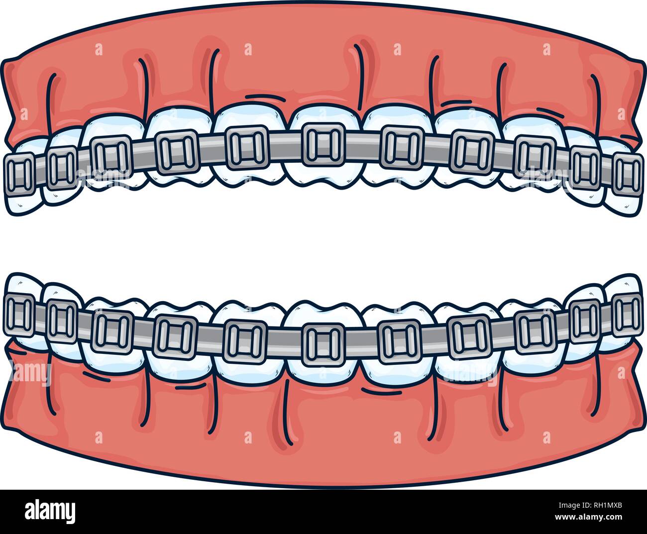 human teeth with orthodontics Stock Vector Image & Art - Alamy