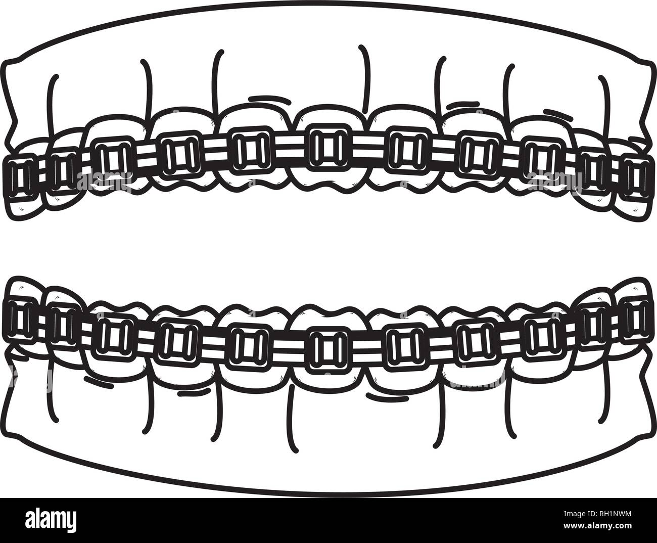 human teeth with orthodontics Stock Vector Image & Art - Alamy