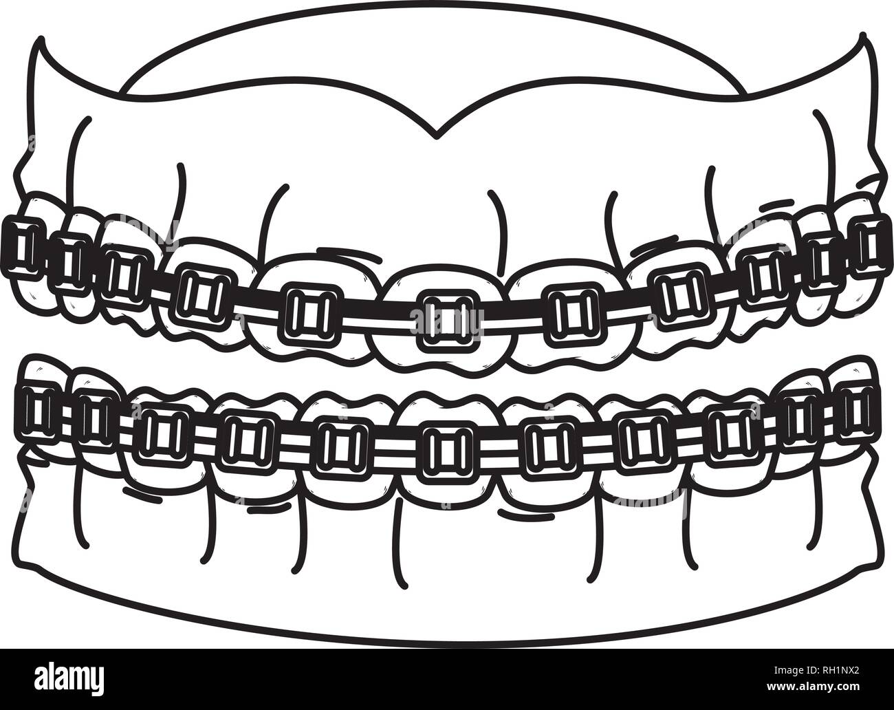 human teeth with orthodontics Stock Vector Image & Art - Alamy