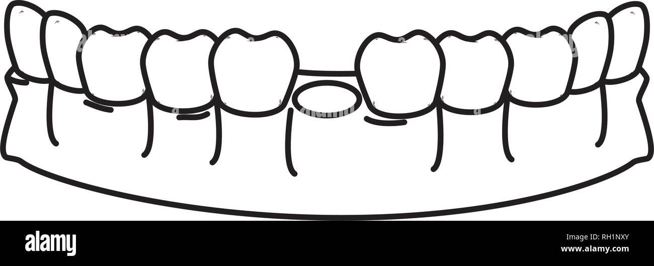 human teeth without one tooth Stock Vector Image & Art - Alamy