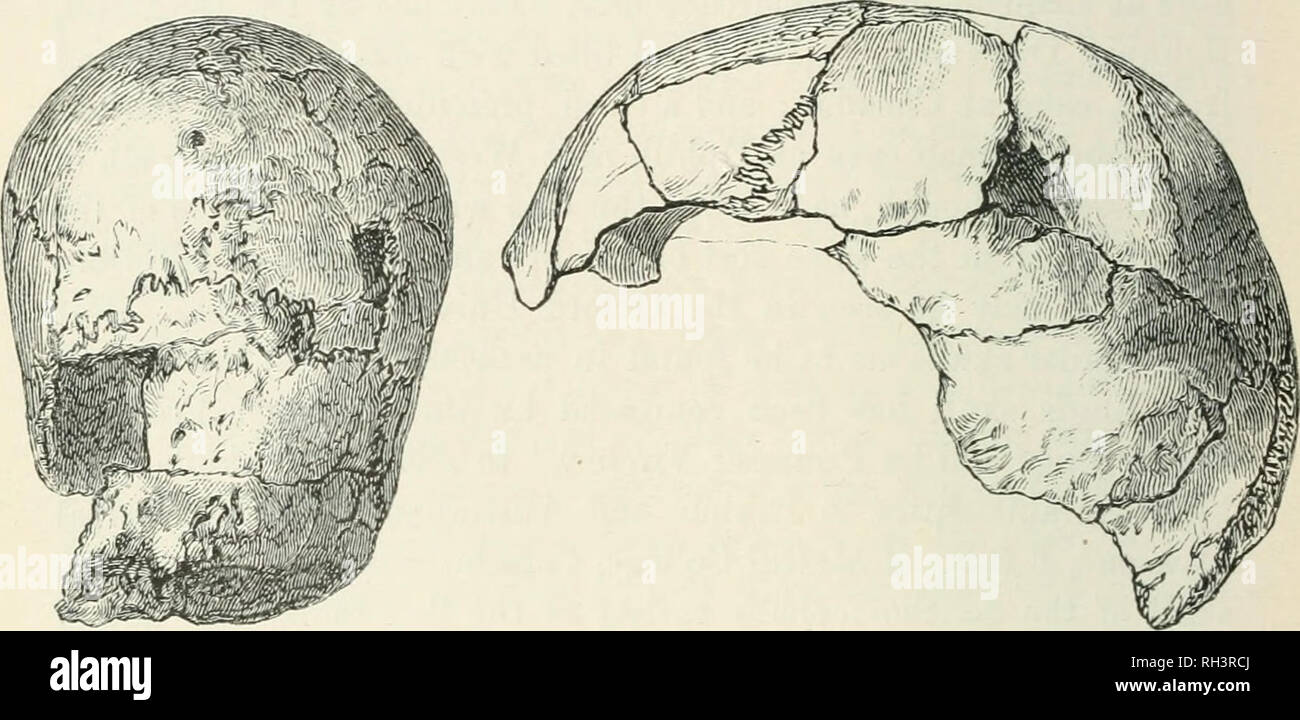 External occipital protuberance hi-res stock photography and images - Alamy
