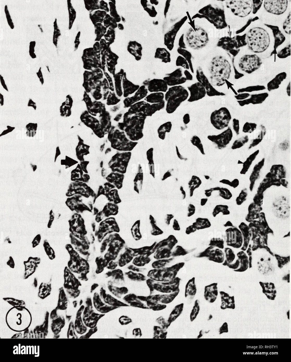 Interlobular duct hi-res stock photography and images - Alamy