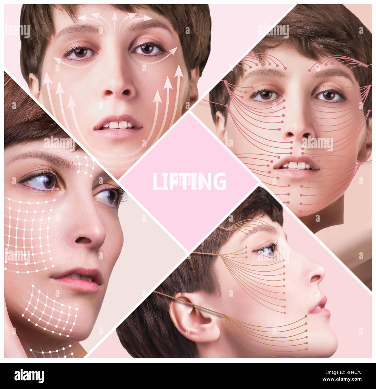 skin plastic surgery concept. Woman face with marks and arrows Stock ...