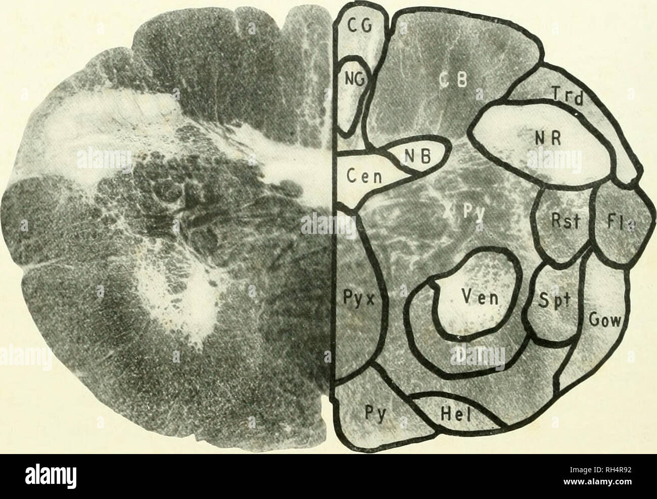 . The brain from ape to man; a contribution to the study of the ...