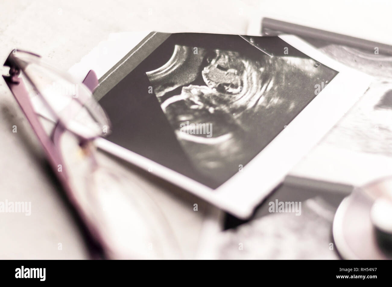 Phonendoscope vs stethoscope and glasses lie on ultrasound images of ...