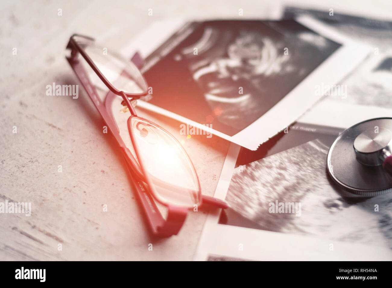 Phonendoscope vs stethoscope and glasses lie on ultrasound images of ...