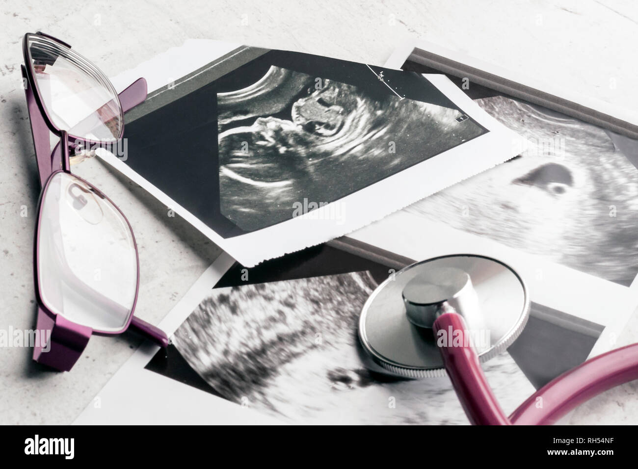 Phonendoscope vs stethoscope and glasses lie on ultrasound images of ...