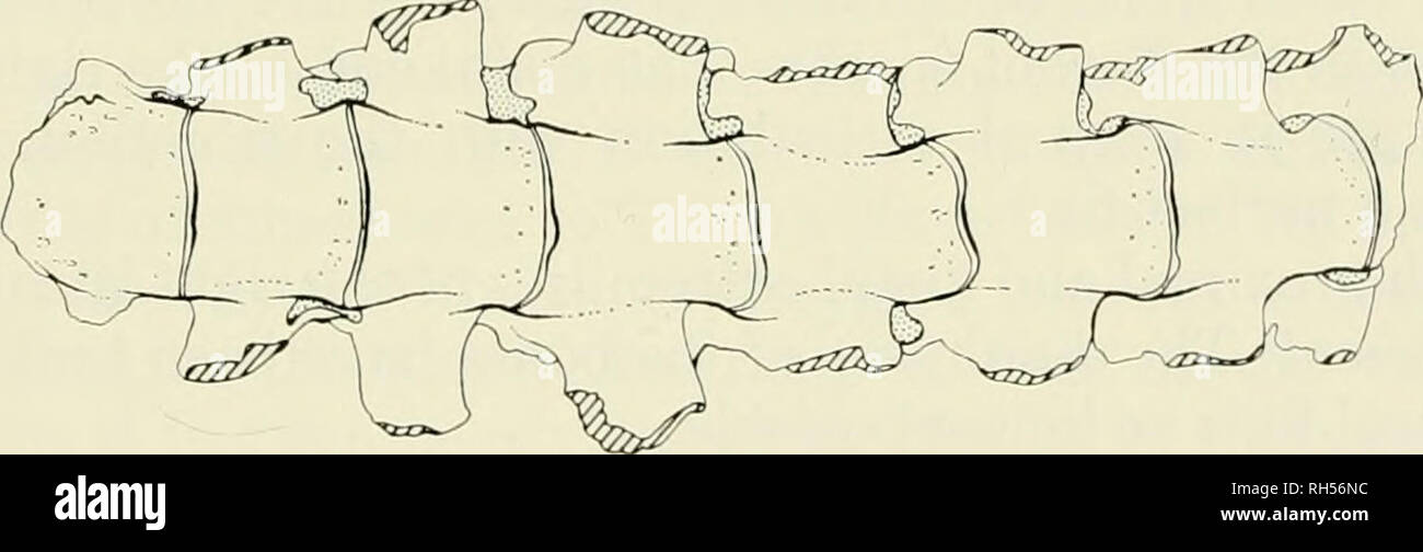 Medial border of scapula hi-res stock photography and images - Alamy