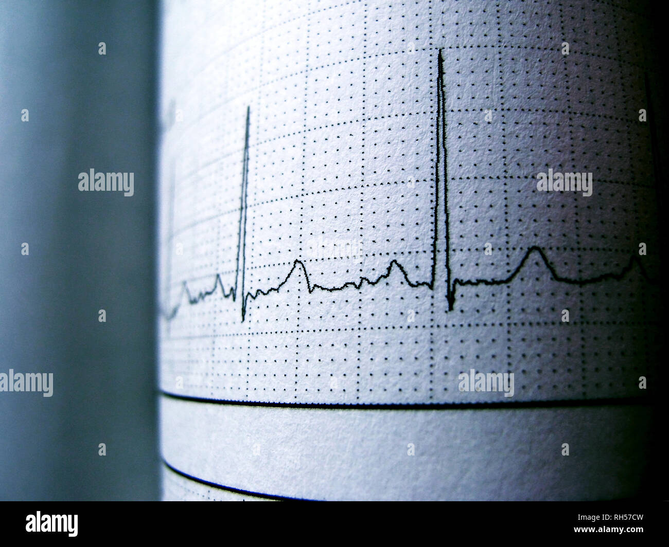 Sinus Heart Rhythm On Electrocardiogram Record Paper Showing Normal P ...