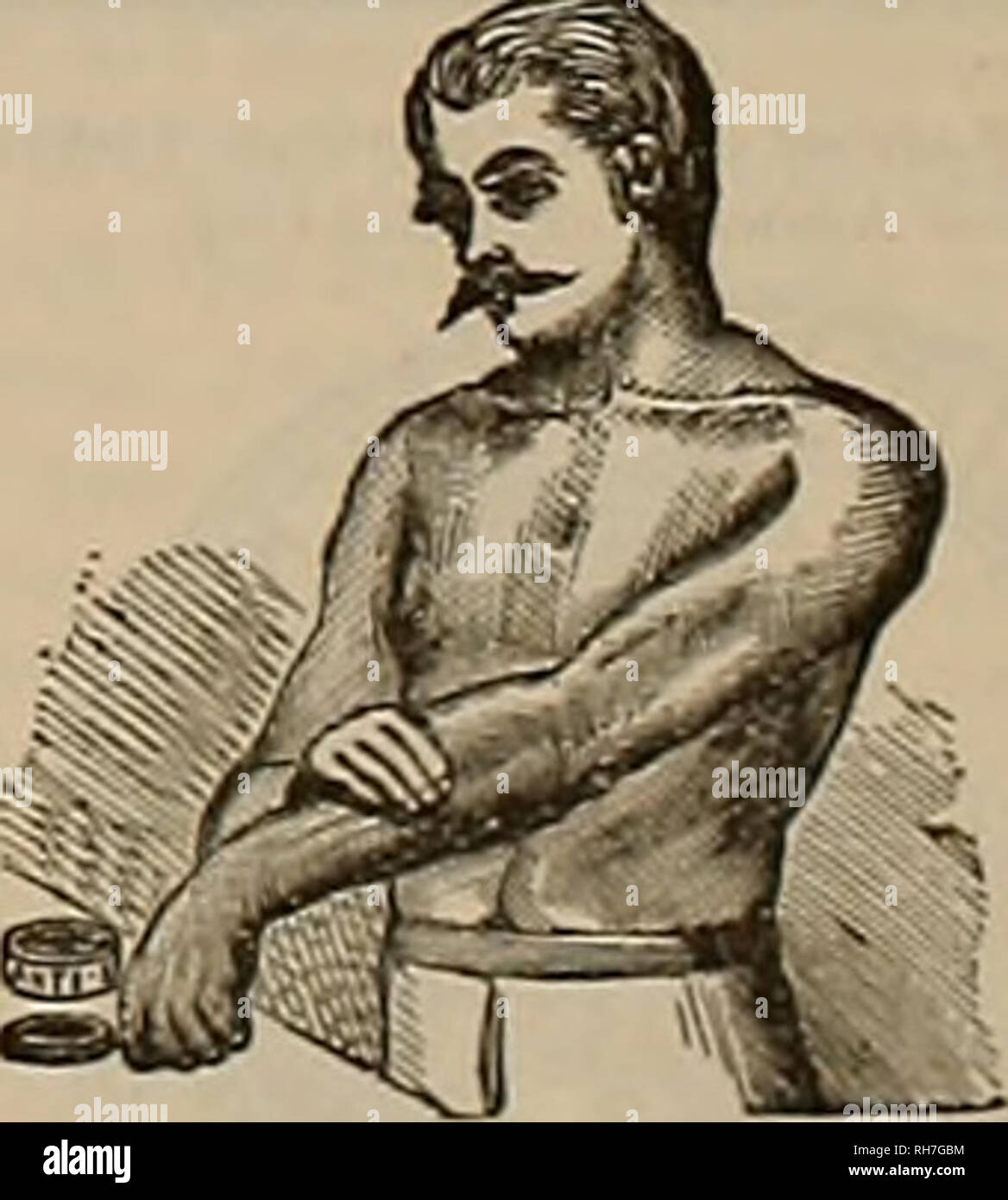 Blood spavin hi-res stock photography and images - Alamy