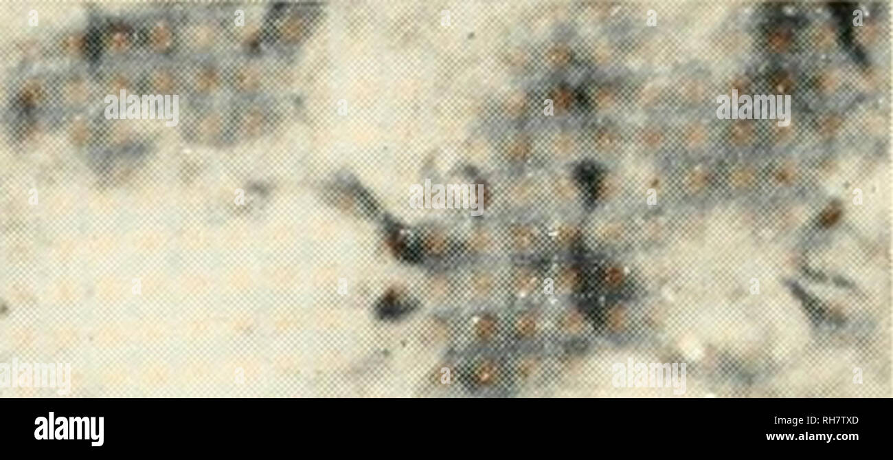 Microvesicles hi-res stock photography and images - Alamy