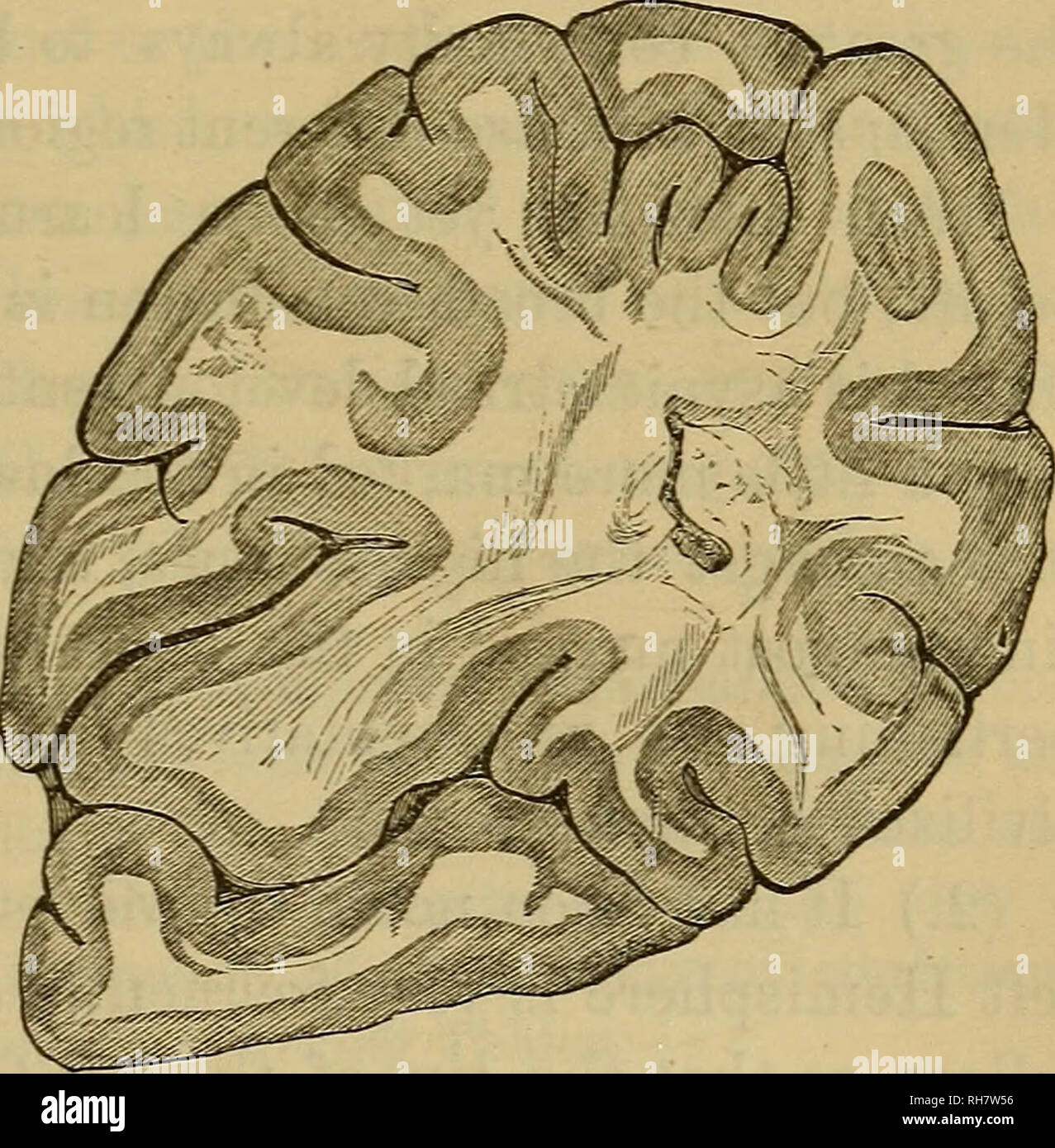 . The brain as an organ of mind. Brain; Thought and thinking; Brain ...