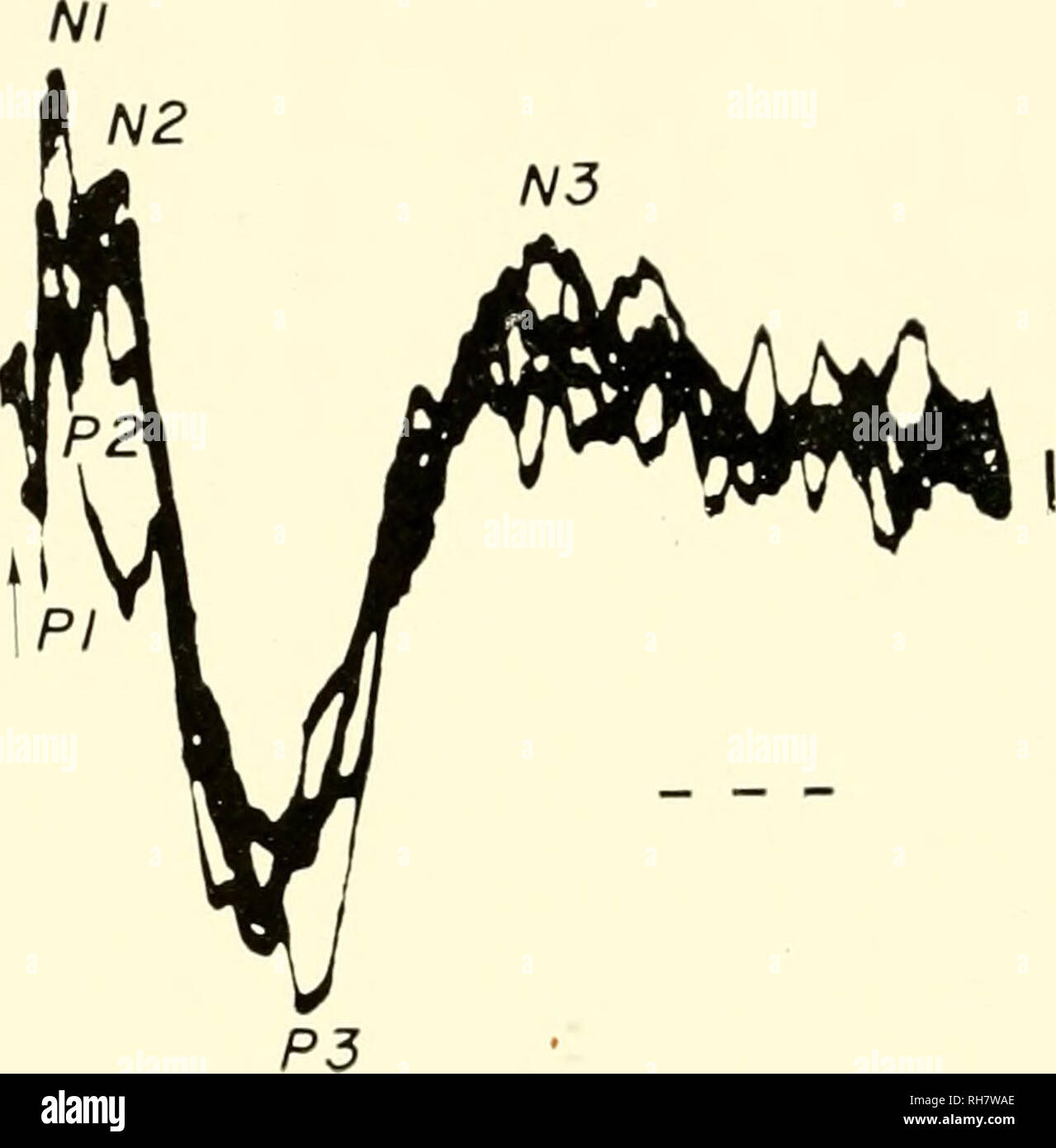 Evoked potentials hi-res stock photography and images - Alamy