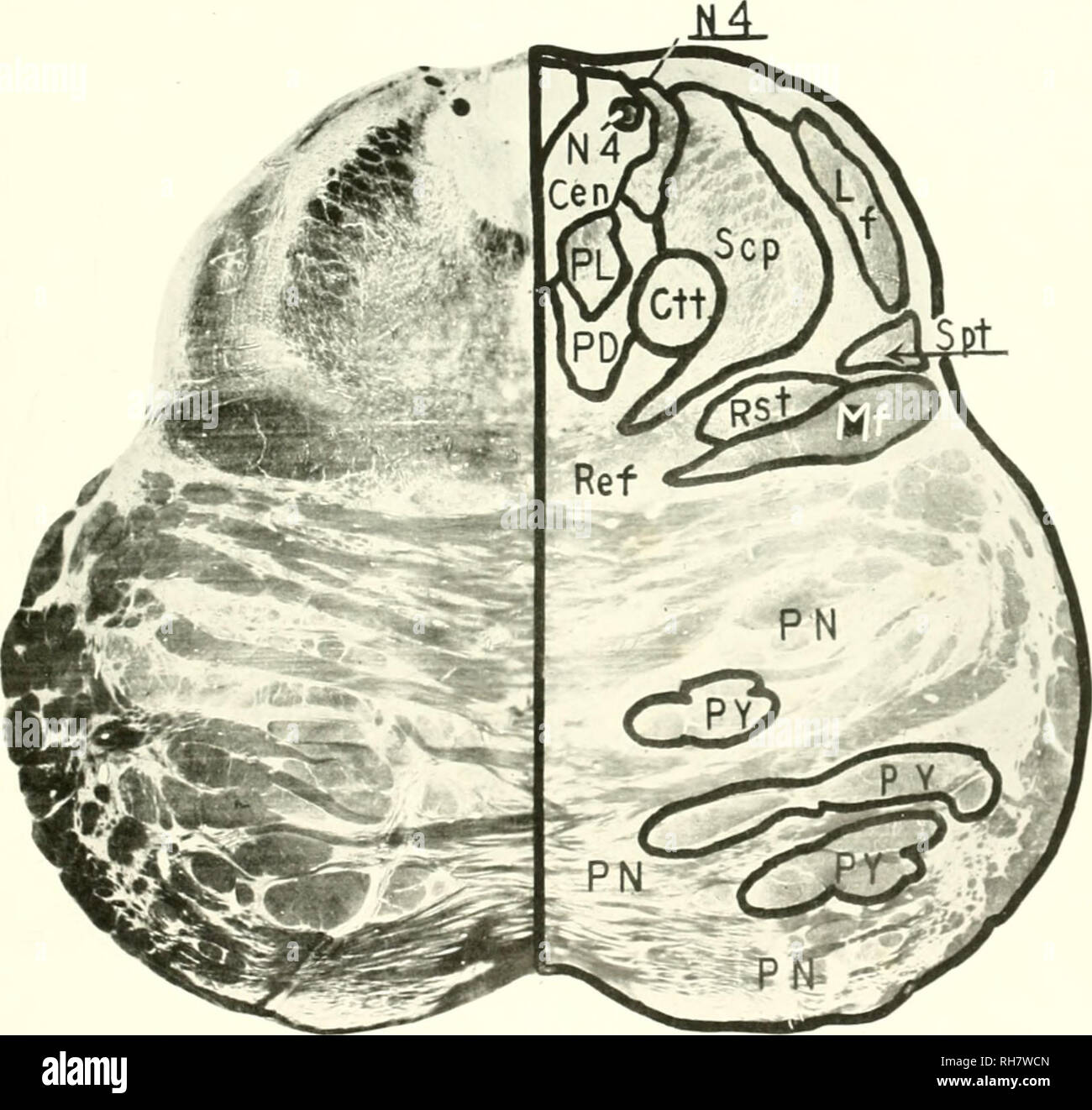 Human evolution brain size hi-res stock photography and images - Alamy