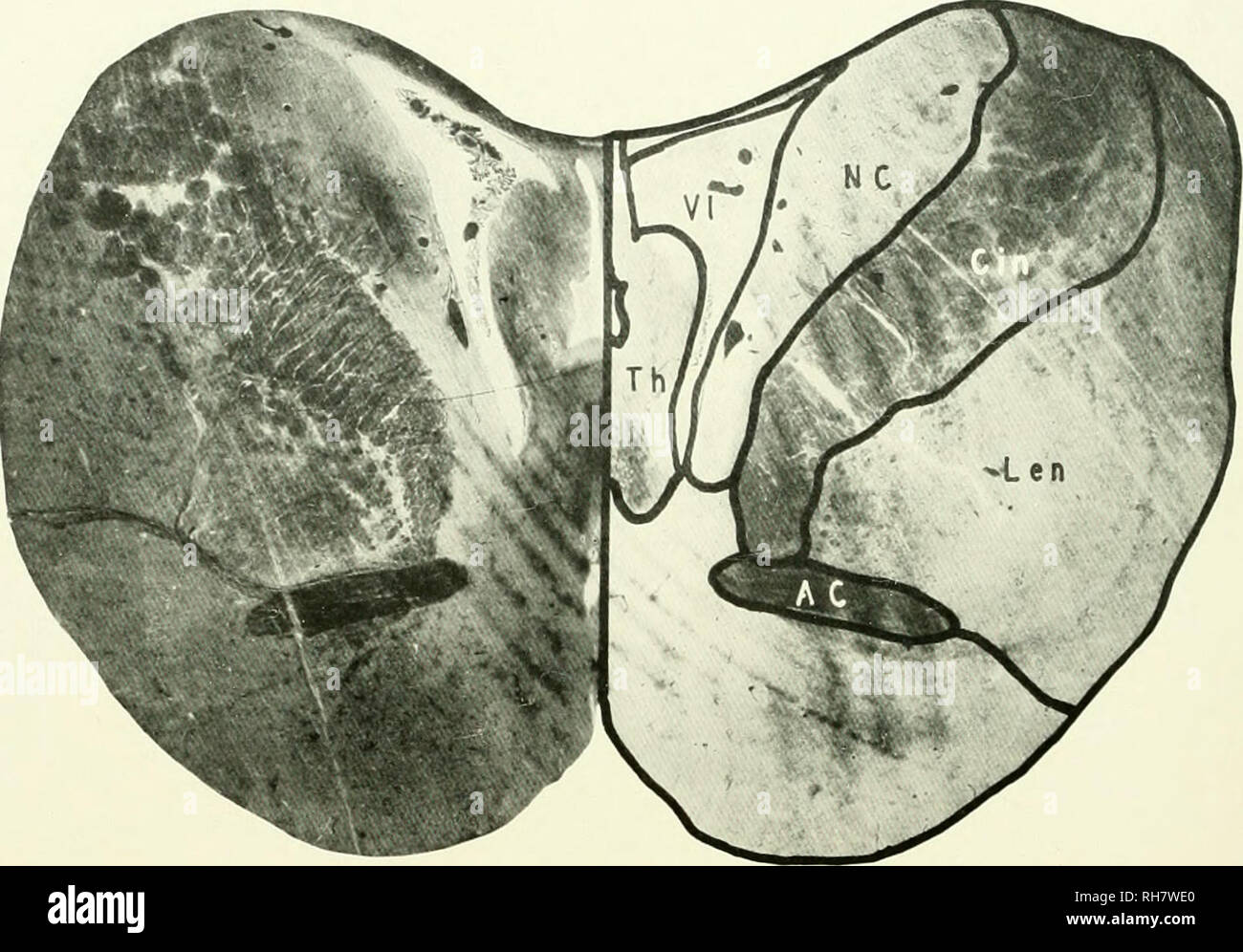 . The brain from ape to man; a contribution to the study of the ...