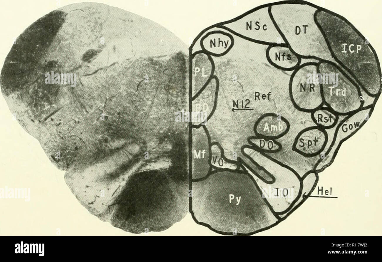 Human evolution brain size hi-res stock photography and images - Alamy